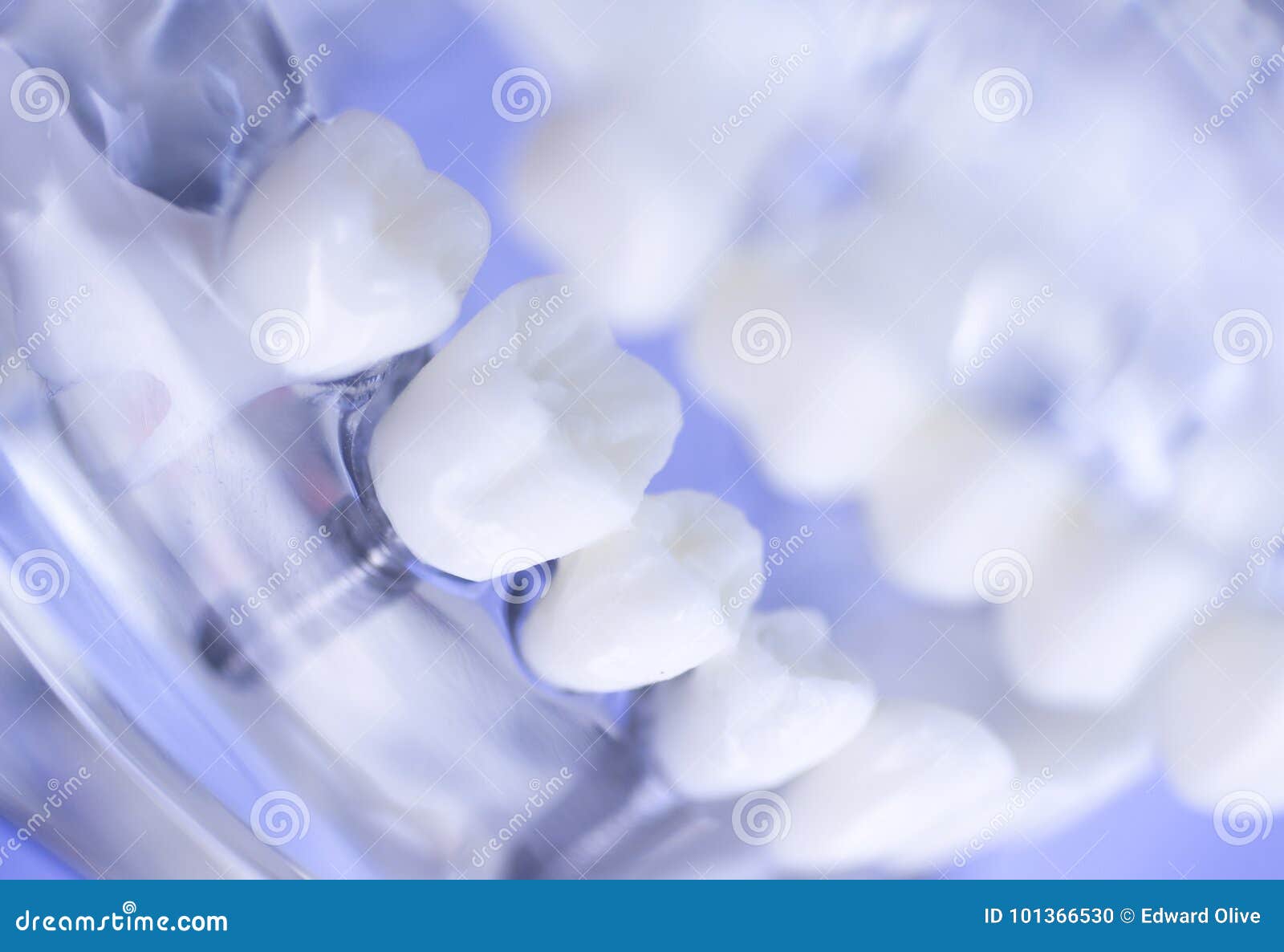 Modelo Dental De La Boca De Los Dientes Foto de archivo - Imagen de ...