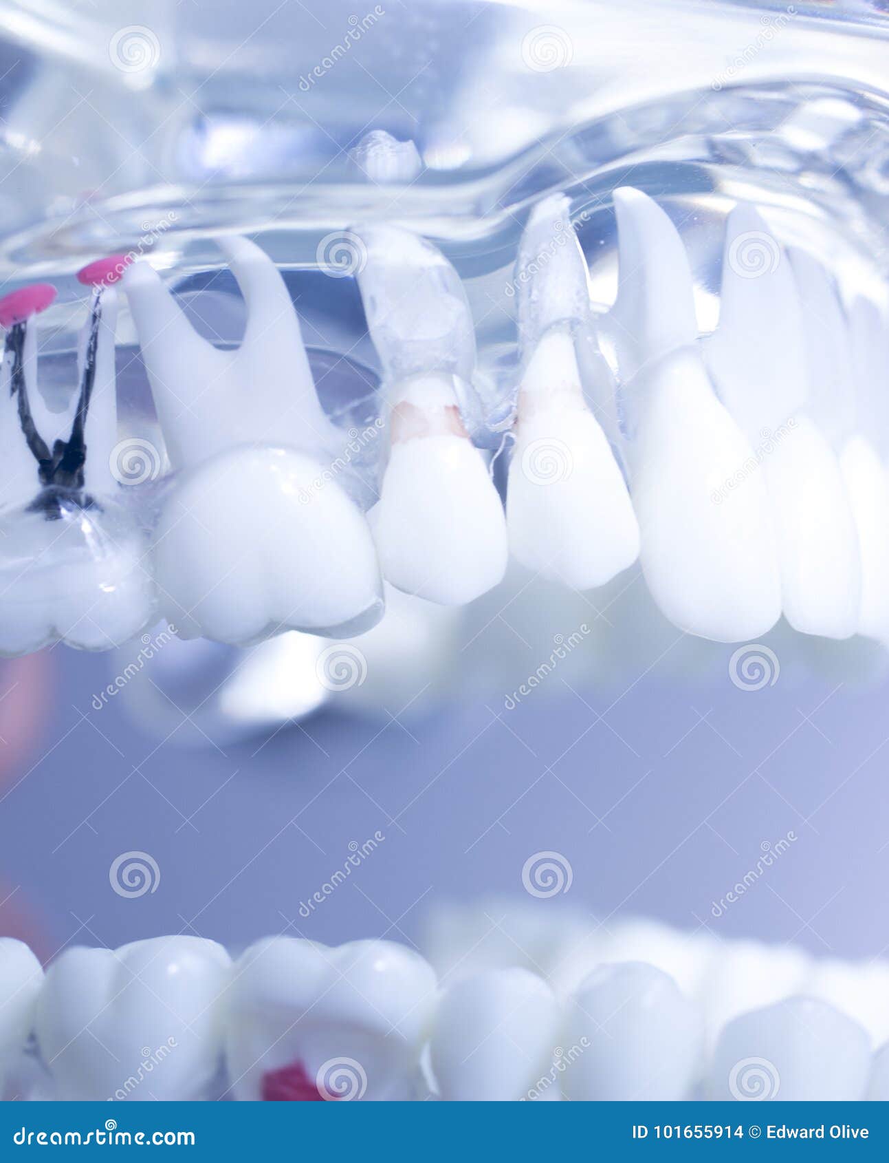 Modelo Dental De La Boca De Los Dientes Foto de archivo - Imagen de ...