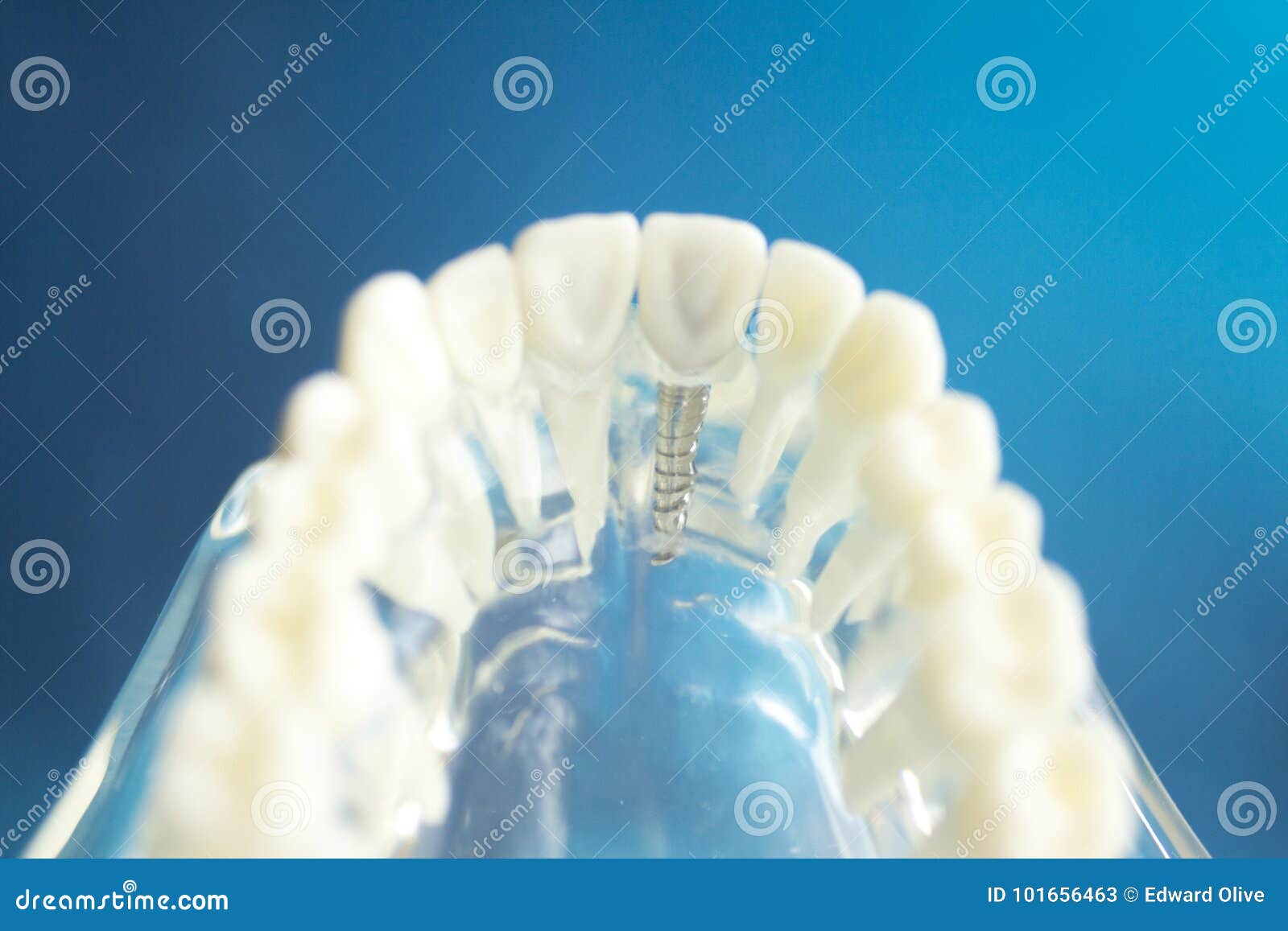 Modelo Dental De La Boca De Los Dientes Imagen de archivo - Imagen de ...