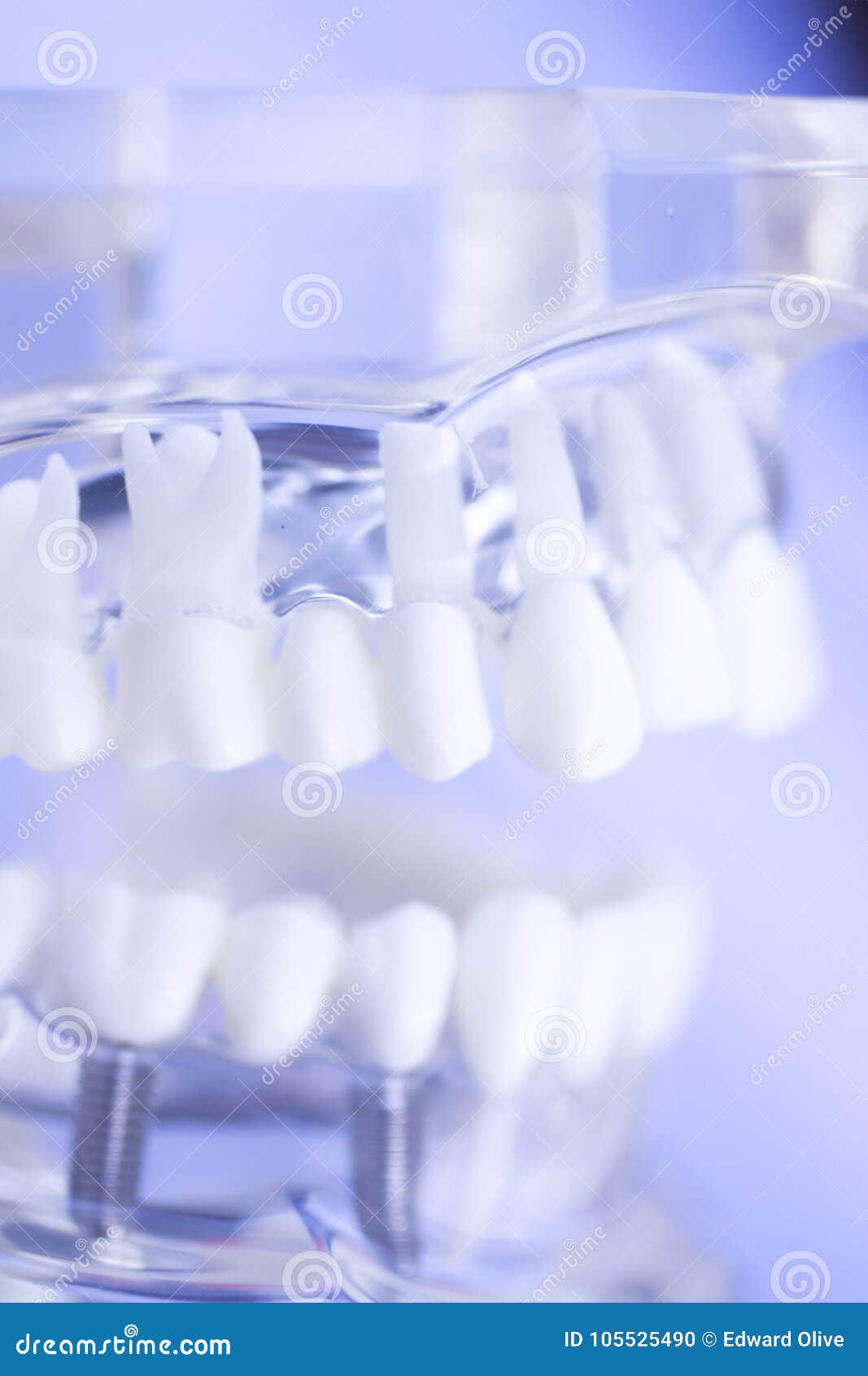 Modelo Dental De La Boca De Los Dientes Foto de archivo - Imagen de ...
