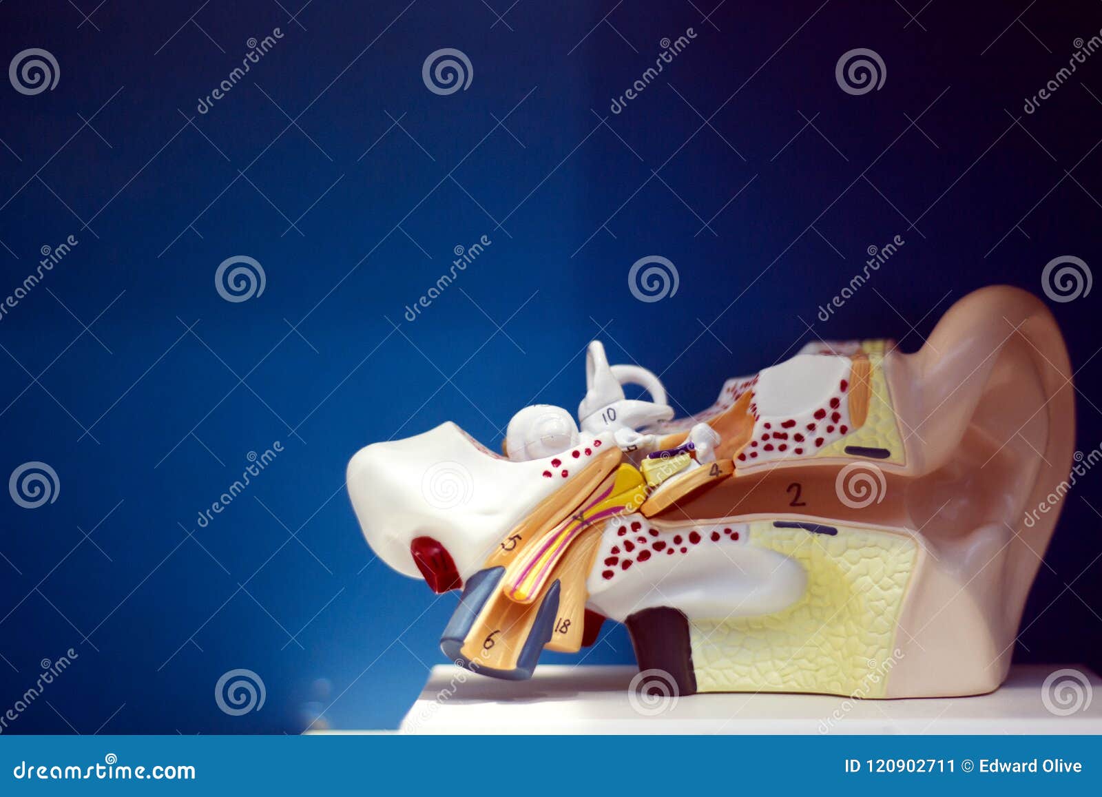 Modelo Médico De La Sordera Del Oído Imagen de archivo - Imagen de ...