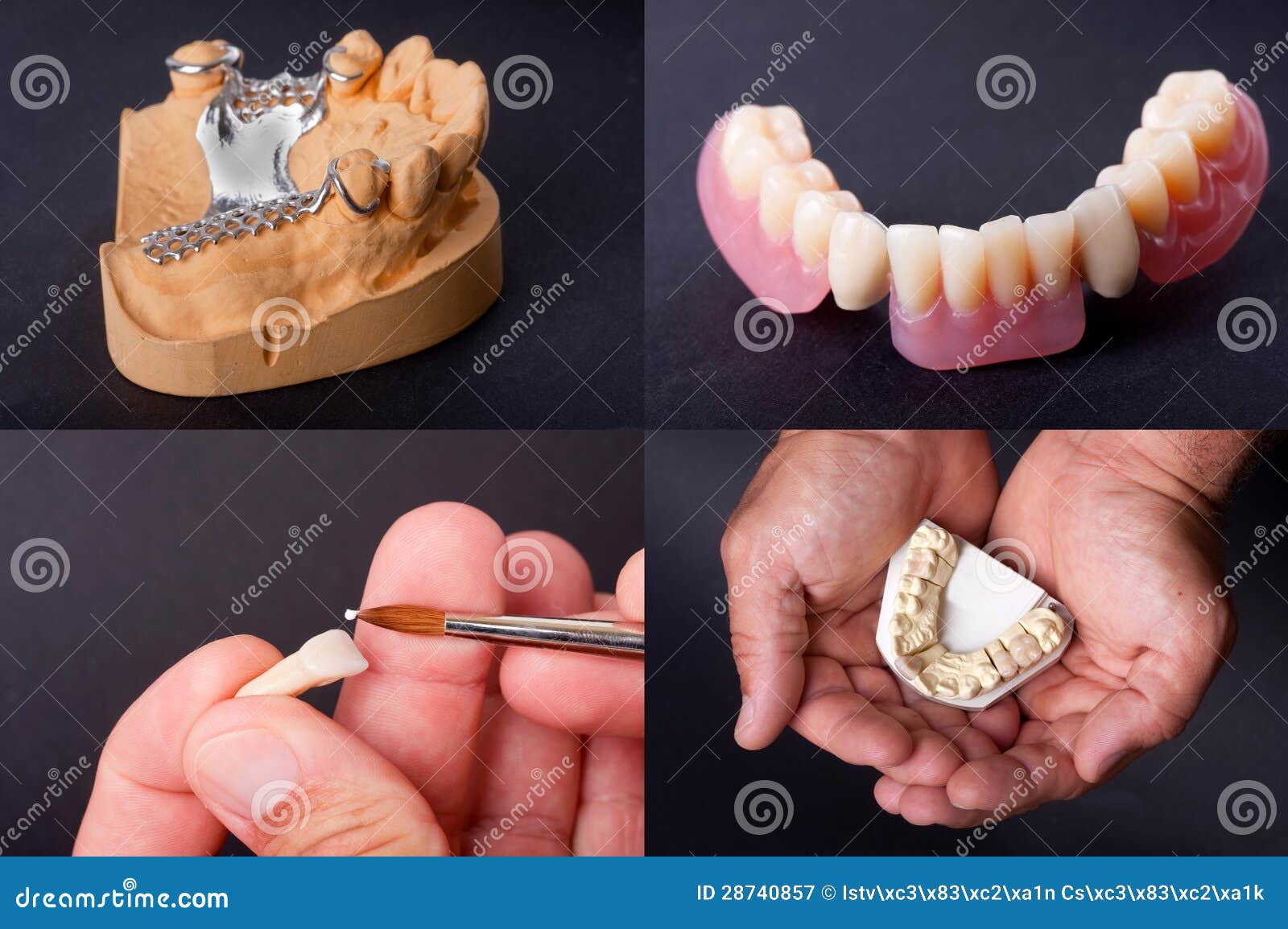 Modelos Dentales De La Cera Imagen de archivo - Imagen de toothache ...