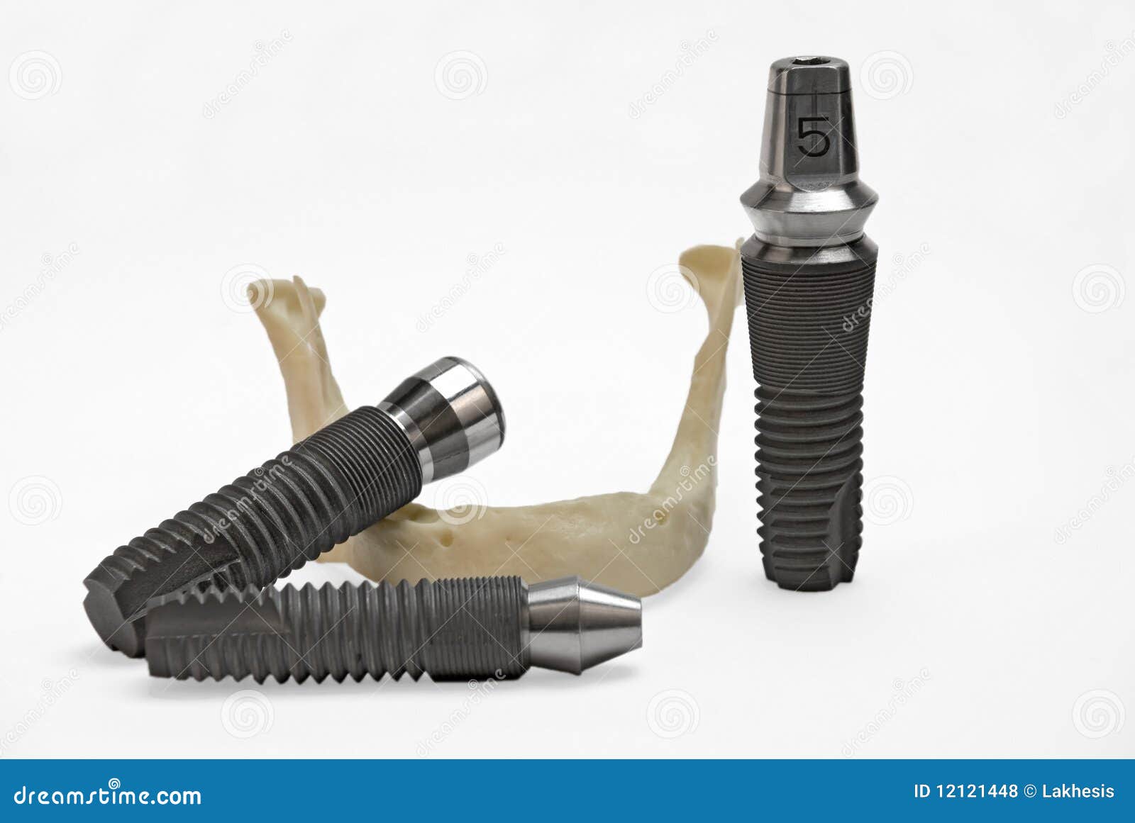 MODELS of DENTAL IMPLANTS stock photo. Image of dentistry - 12121448