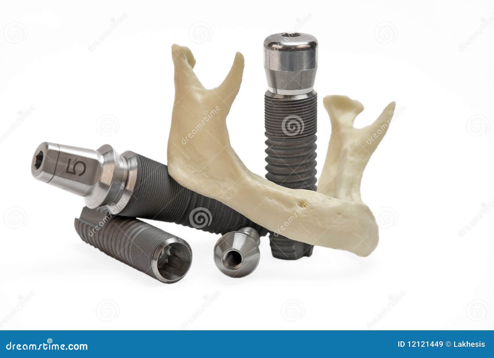 MODELS of DENTAL IMPLANTS stock image. Image of clinic - 12121449