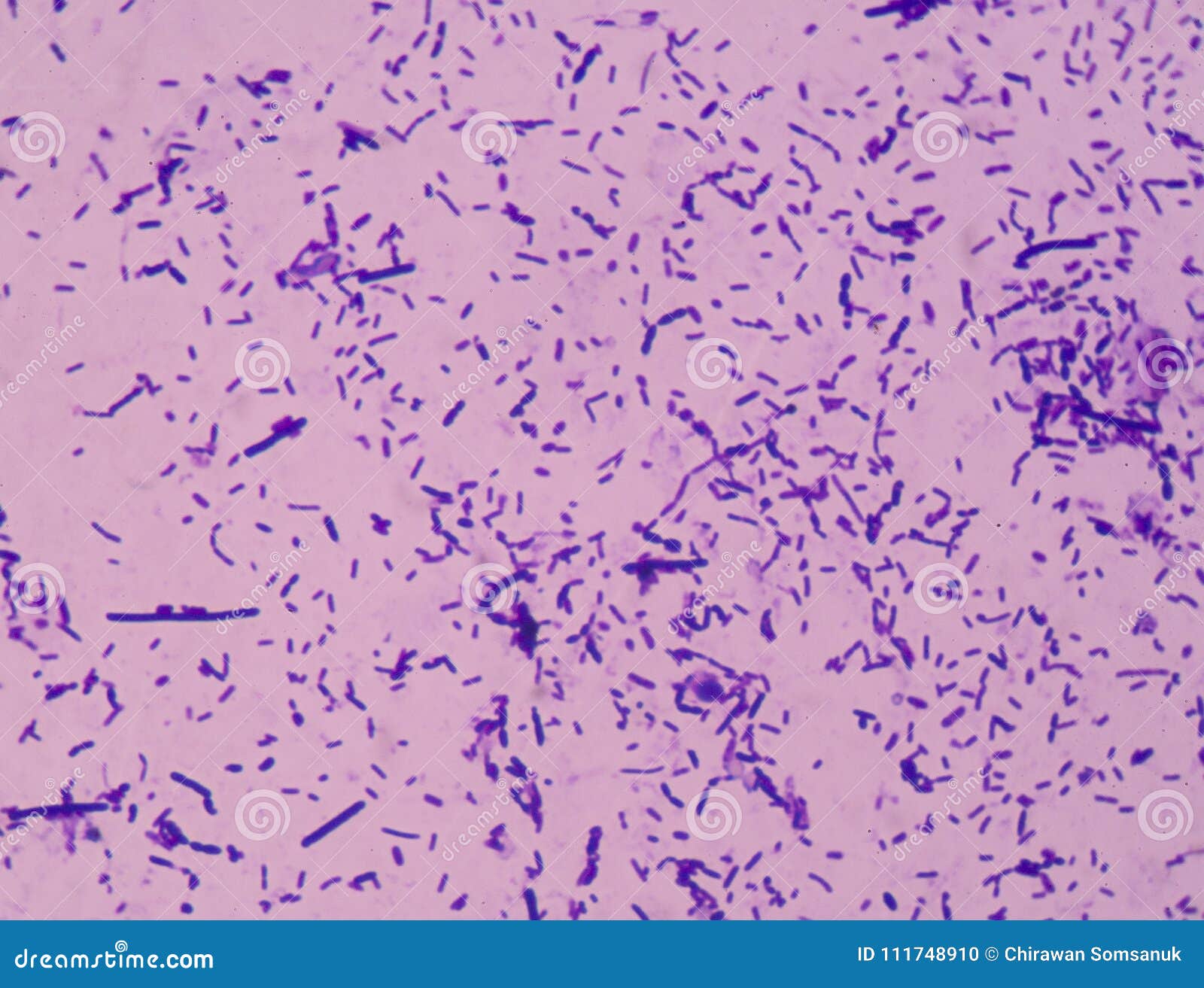 Moderate Bacteria And White Blood Cells In Patien Bacteria Urinary ...