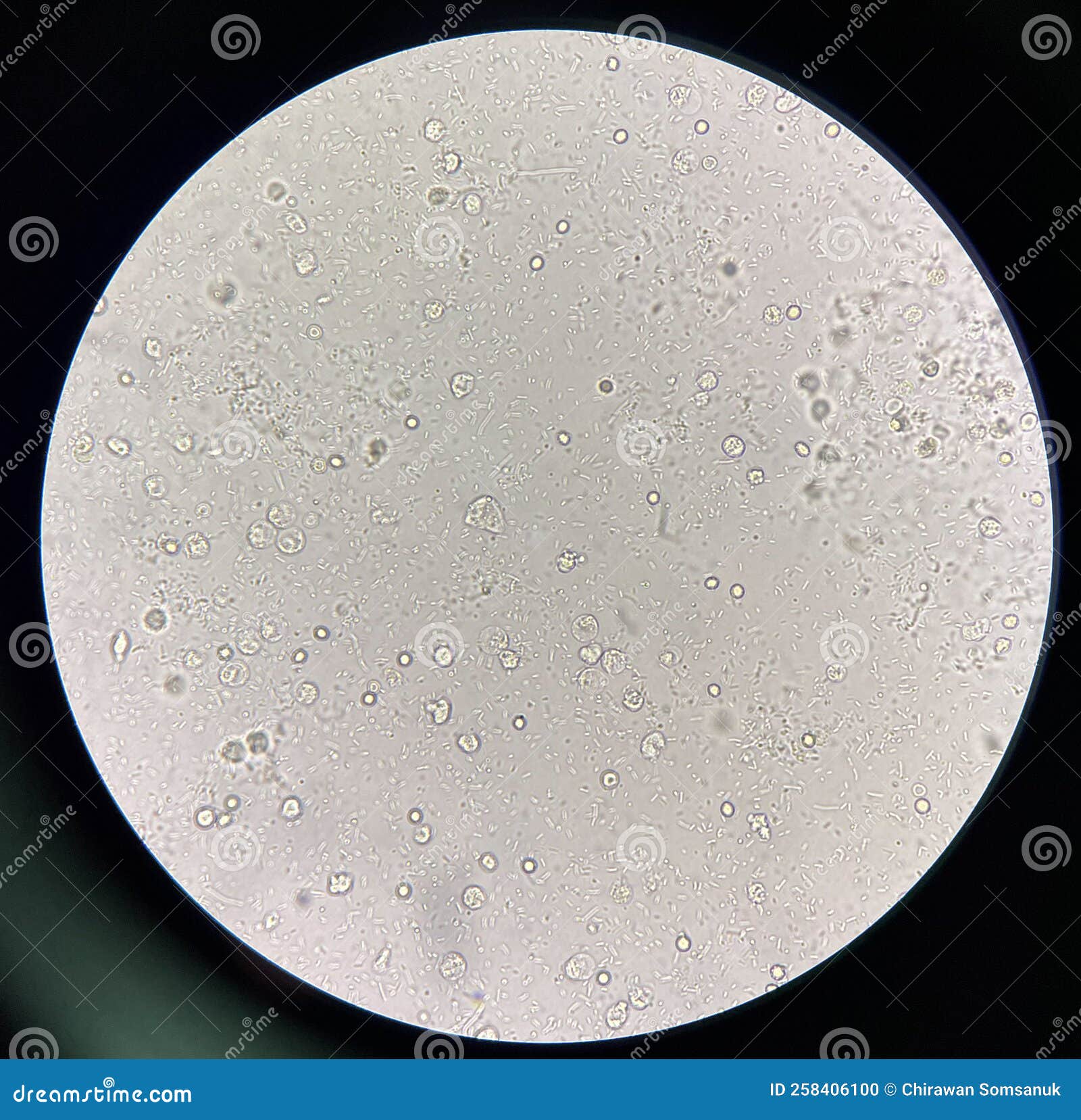 Moderate Bacteria in Urine Sample Stock Photo - Image of medical ...