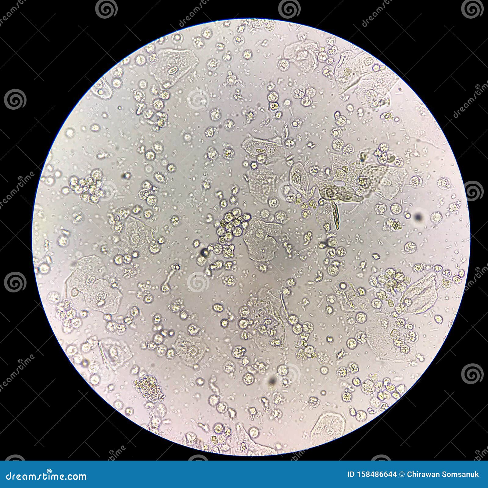 Struvites At The Microscope Royalty-Free Stock Image | CartoonDealer ... Struvites At The Microscope Royalty-Free Stock Image | CartoonDealer ...