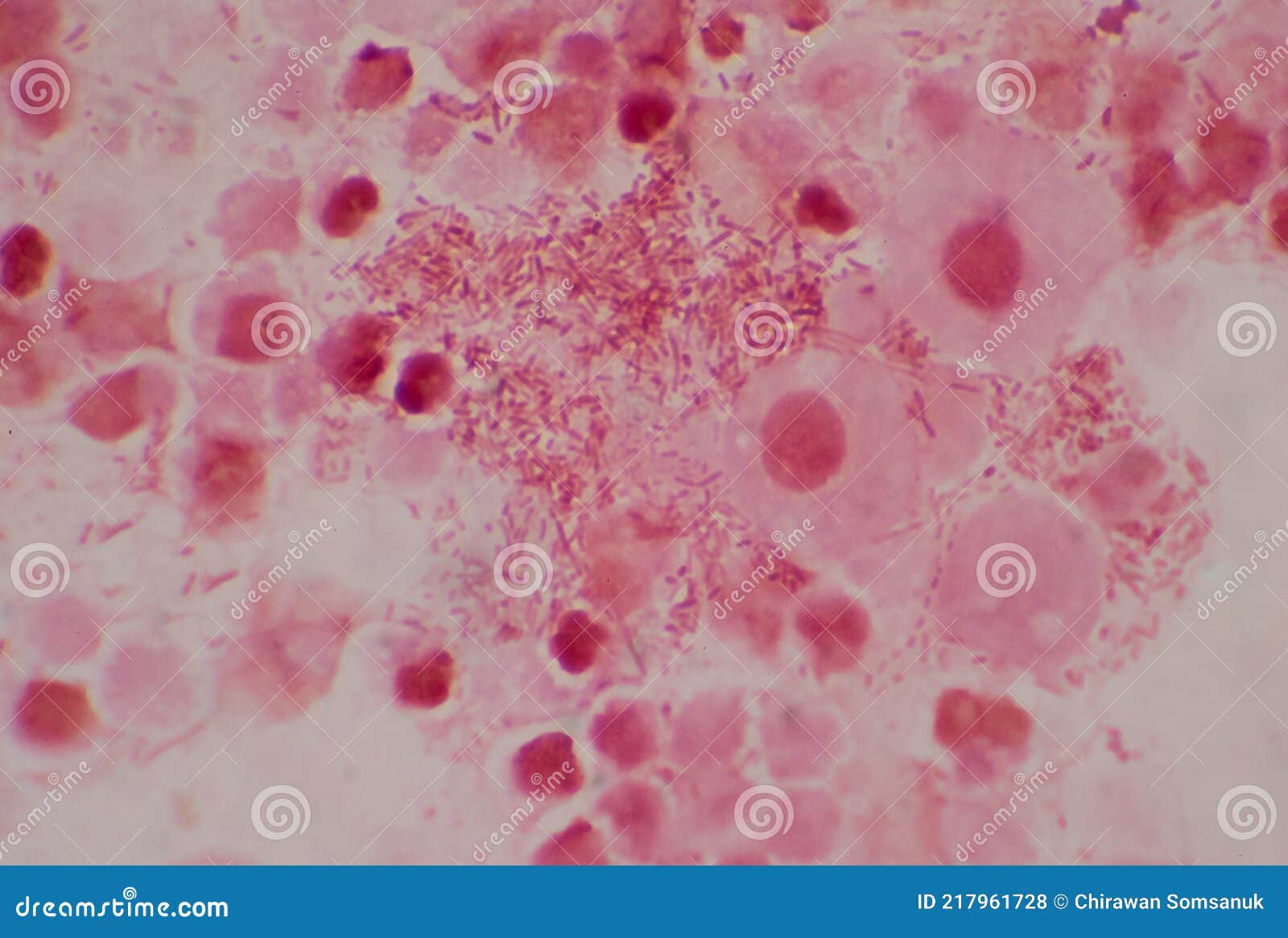 Bacillus Gram Positive Stain Under Microscope View. Bacillus Is Rod ...