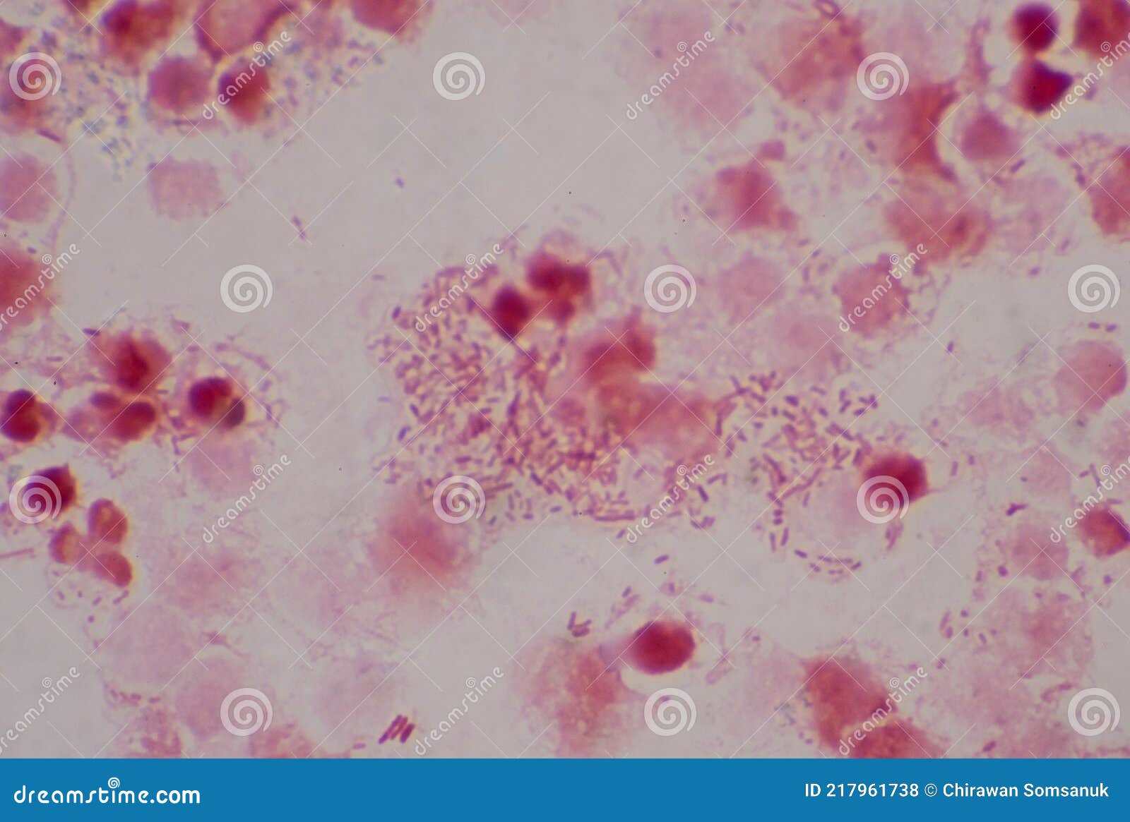 Bacillus Gram Positive Stain Under Microscope View. Bacillus Is Rod ...