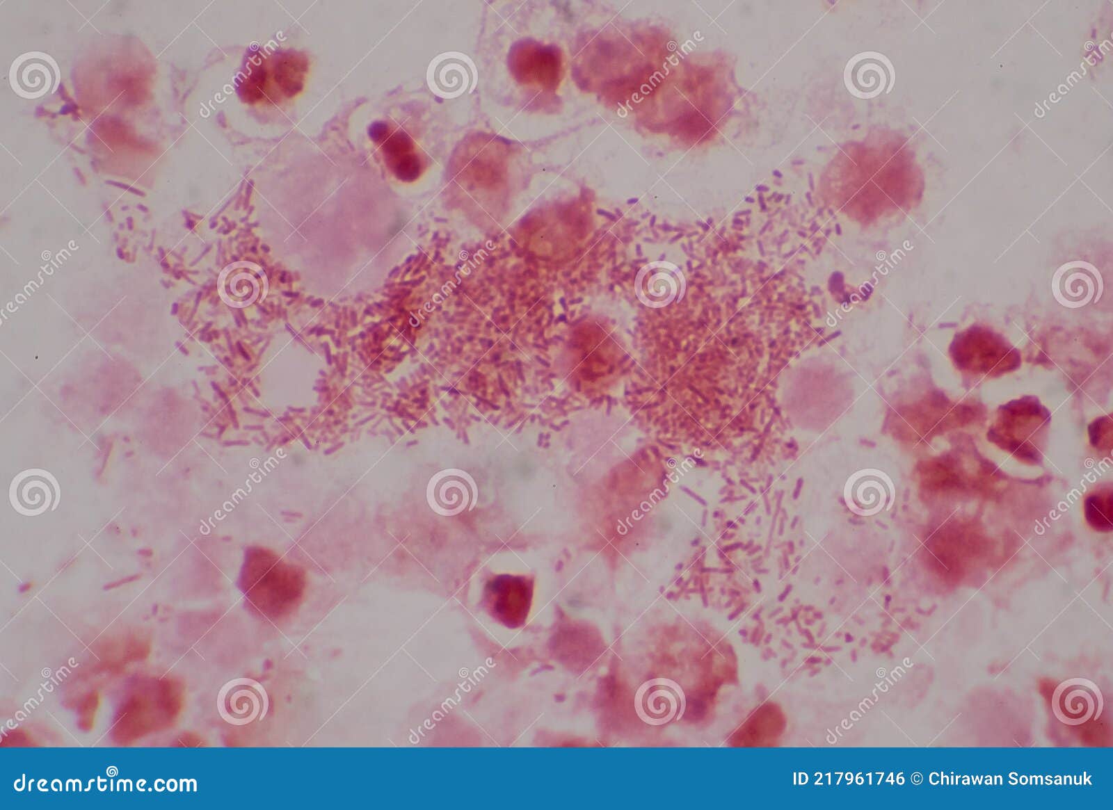 Bacillus Gram Positive Stain Under Microscope View. Bacillus Is Rod ...