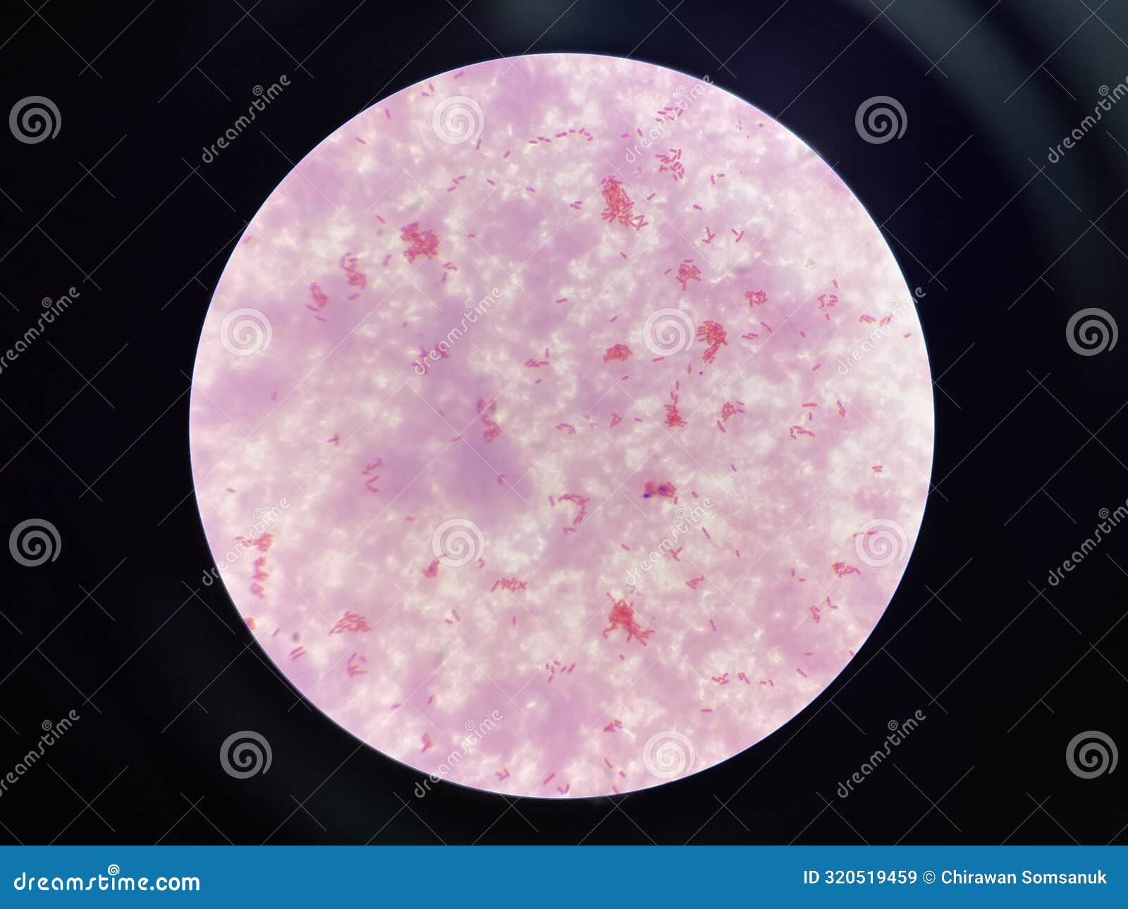 Moderate Gram Nagative Bacilli With White Blood Cells Royalty-Free ...