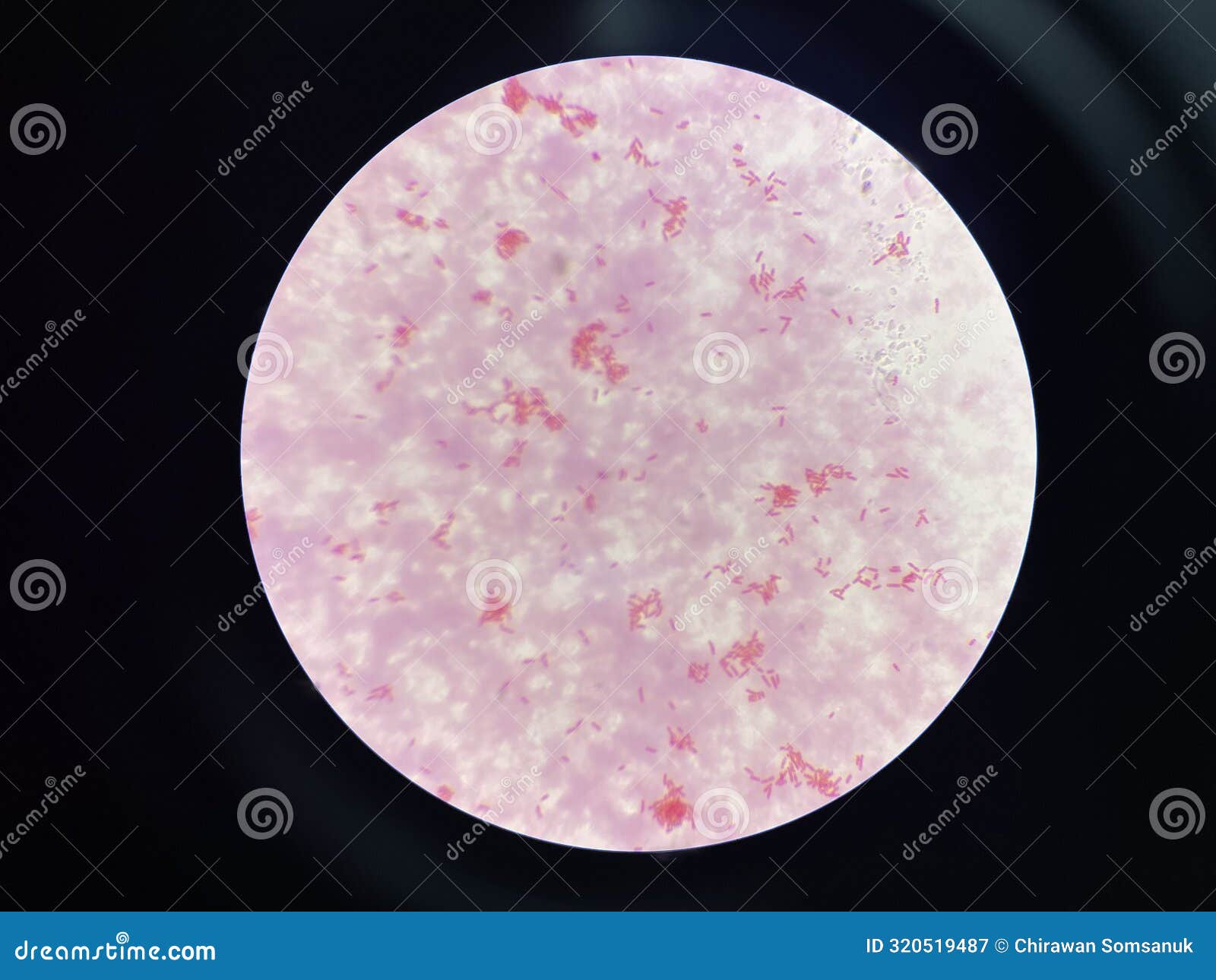 Moderate Gram Nagative Bacilli With White Blood Cells Royalty-Free ...