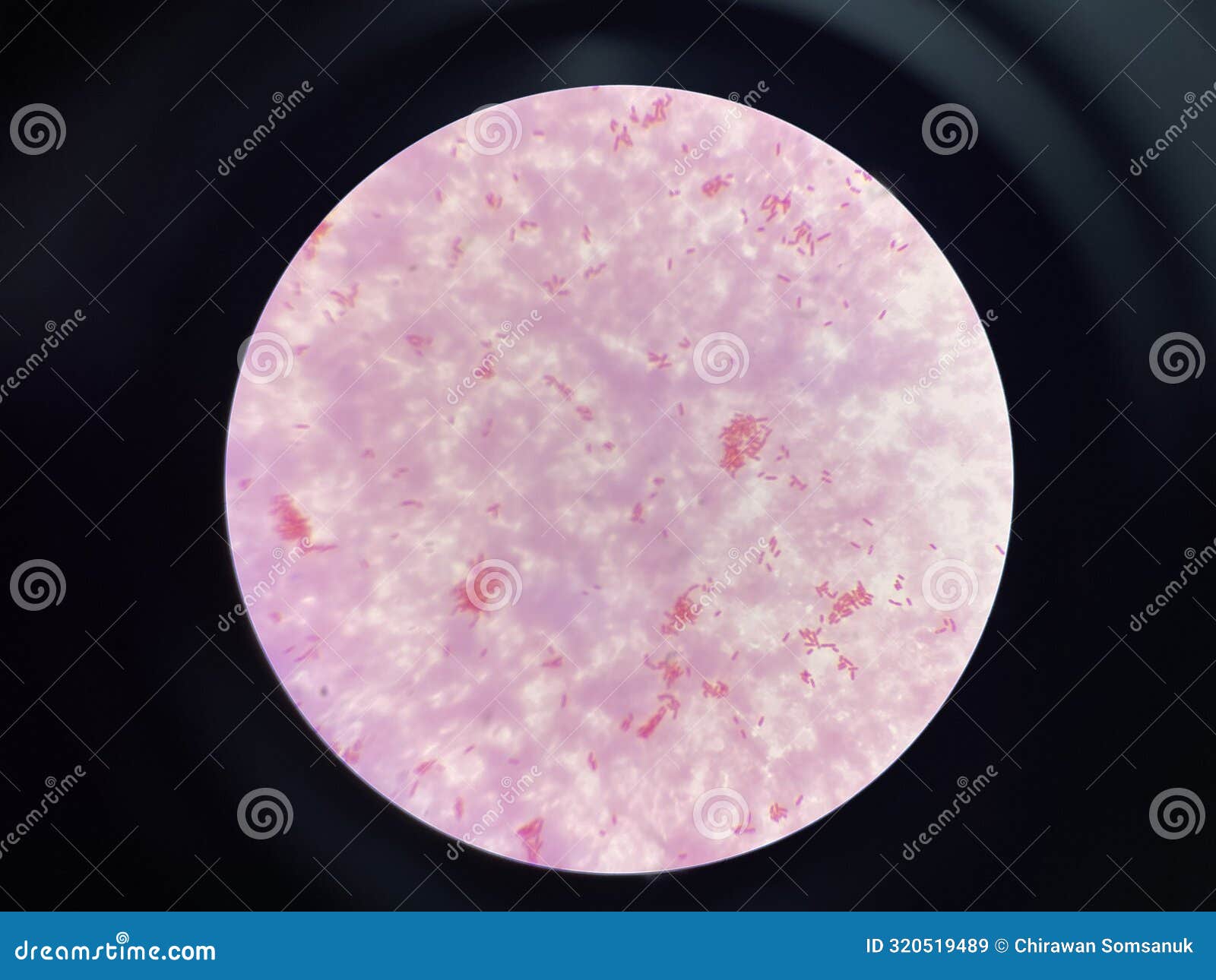 Moderate Gram Nagative Bacilli With White Blood Cells Royalty-Free ...