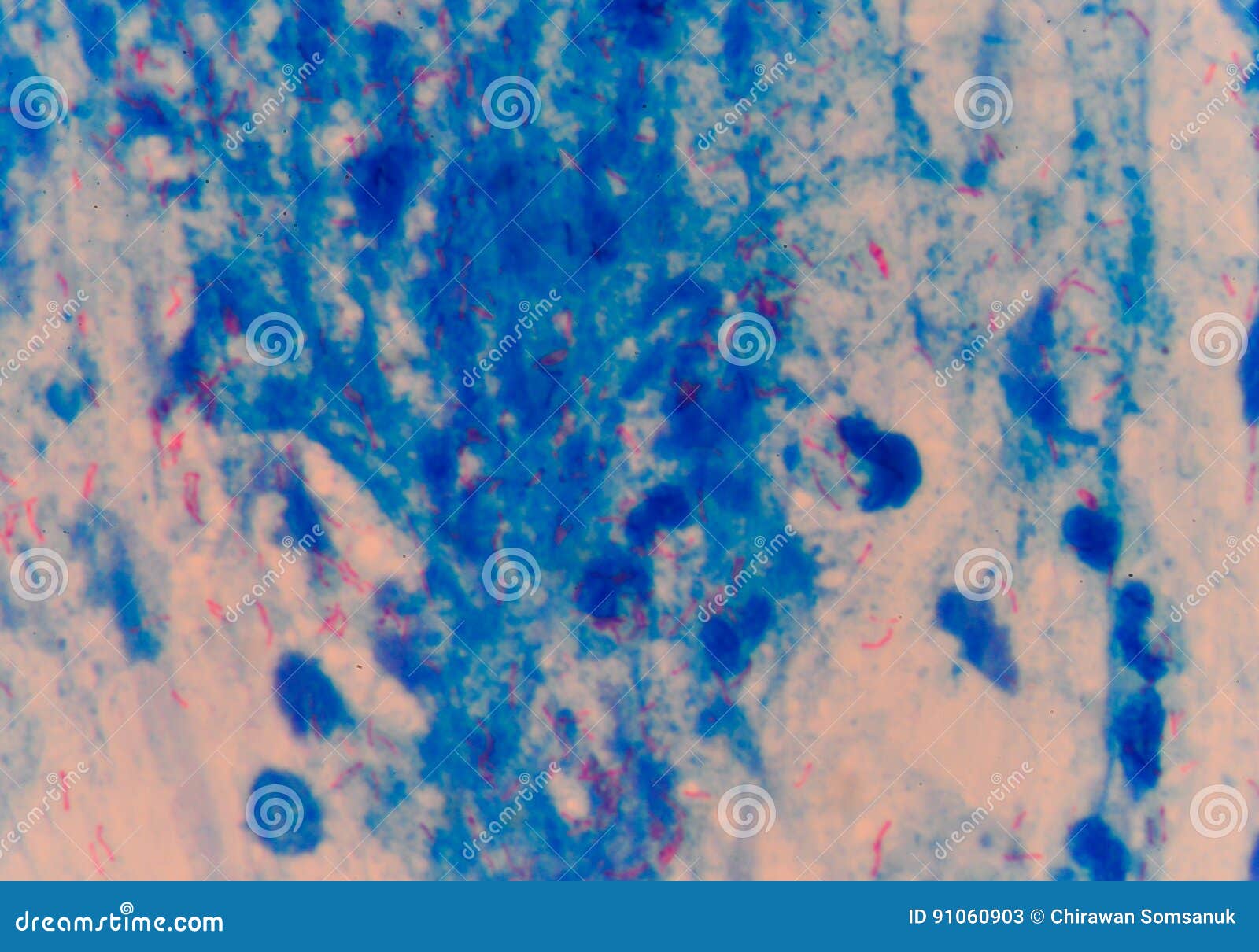 Moderate Red Cells Mycobacterium Tuberculosis Stock Image - Image of ...