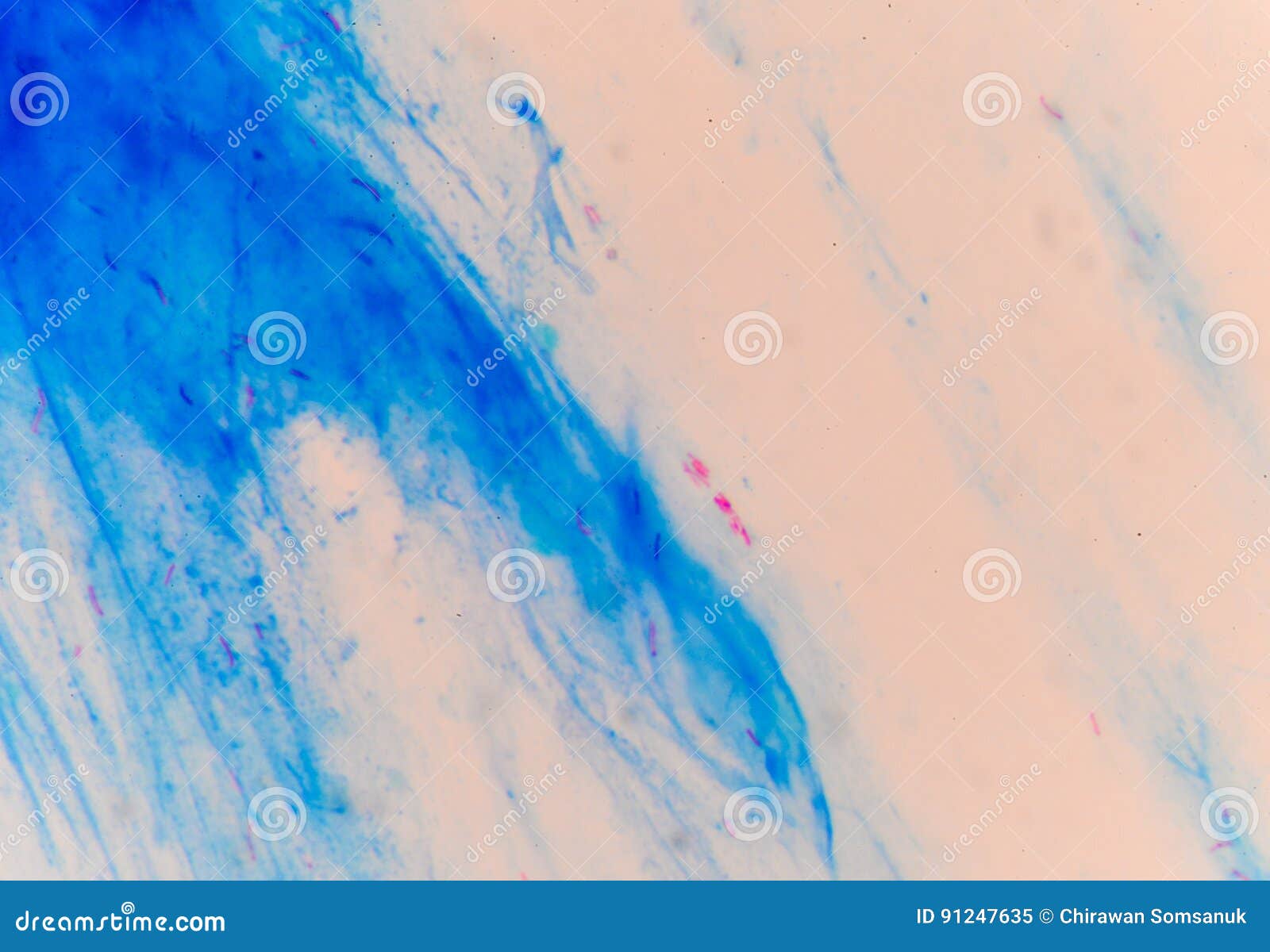 Moderate Red Cells Mycobacterium Tuberculosis Stock Image - Image of ...