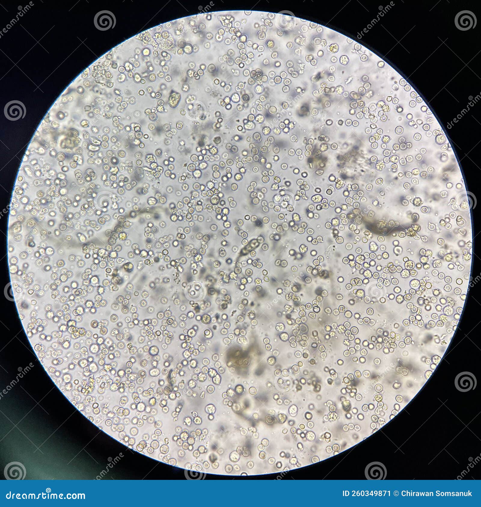 Moderate Turbid Rbc and Wbc in Urine Stock Image - Image of hospital ...