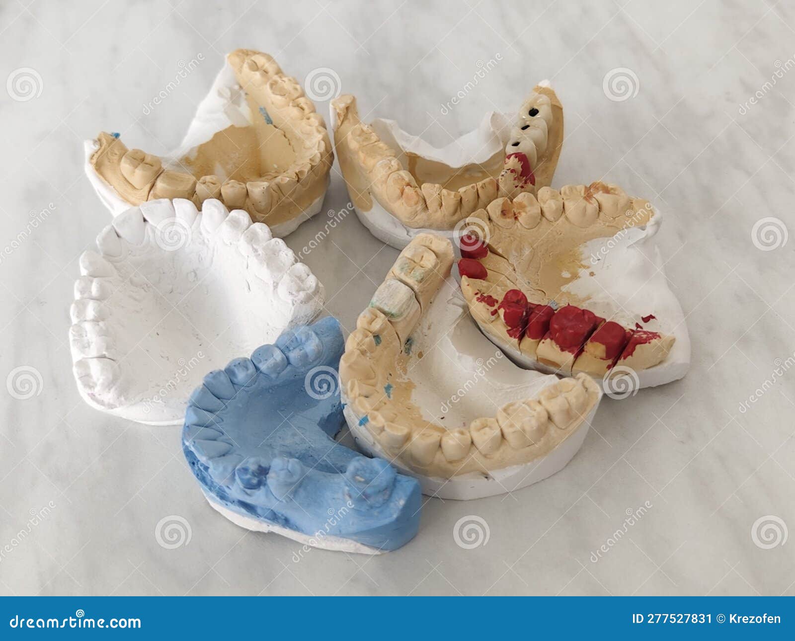 Modern Ceramic-metal Dental Bridge for Restoring Dentition Stock Image ...