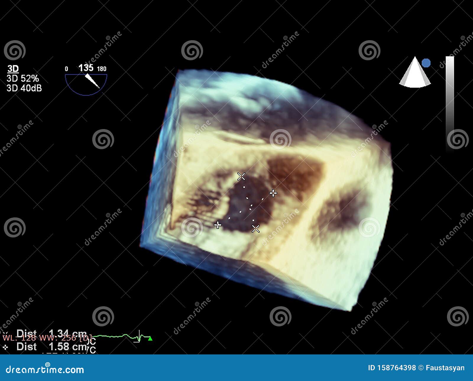 Modern 3D echocardiography stock photo. Image of obstetrics - 158764398