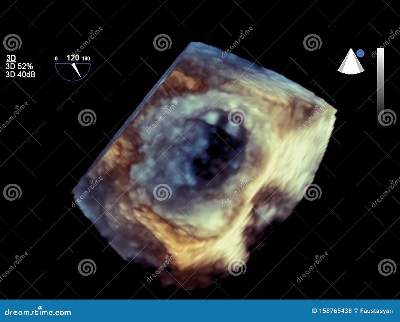 Modern 3D echocardiography stock illustration. Illustration of echo ...