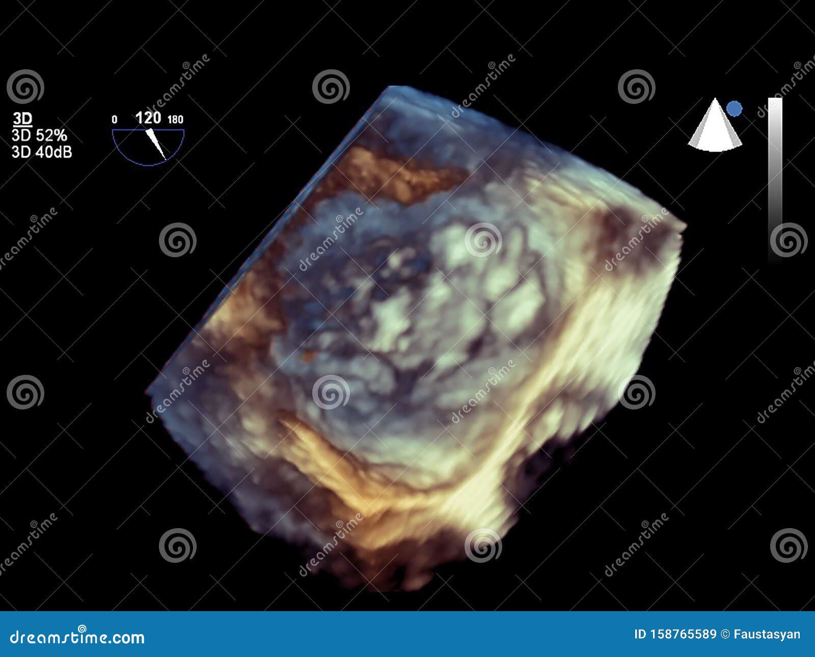 Modern 3D echocardiography stock illustration. Illustration of holding ...
