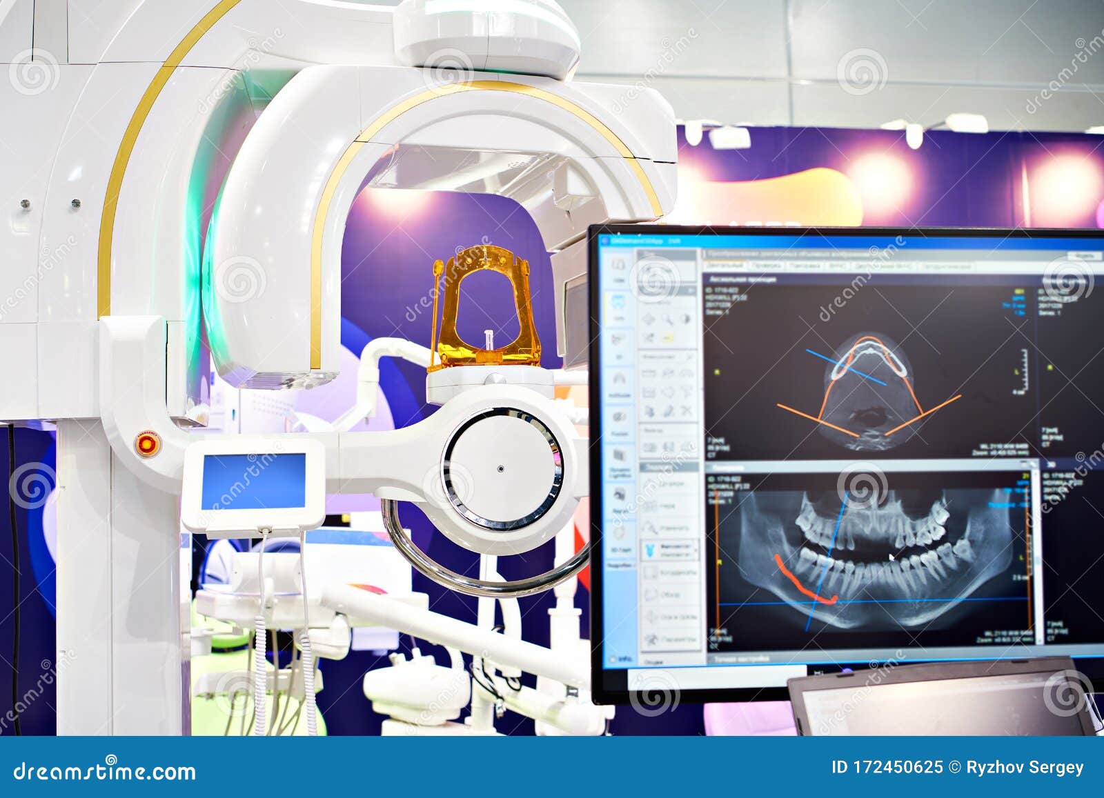 Dental digital tomograph stock image. Image of technology - 172450625