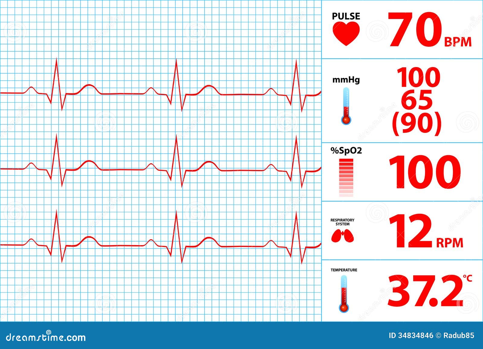 Modern Electrocardiogram Monitor Display Stock Vector - Image: 34834846
