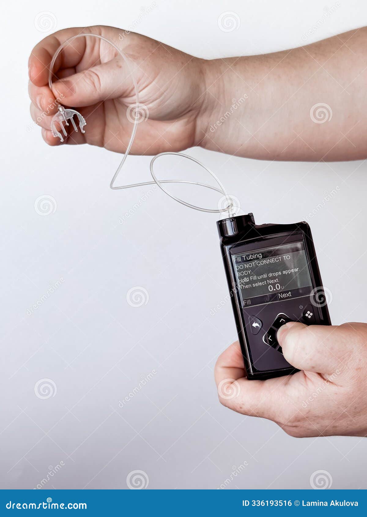 Modern Insulin Pump Device and Sensor Technology for Diabetes ...