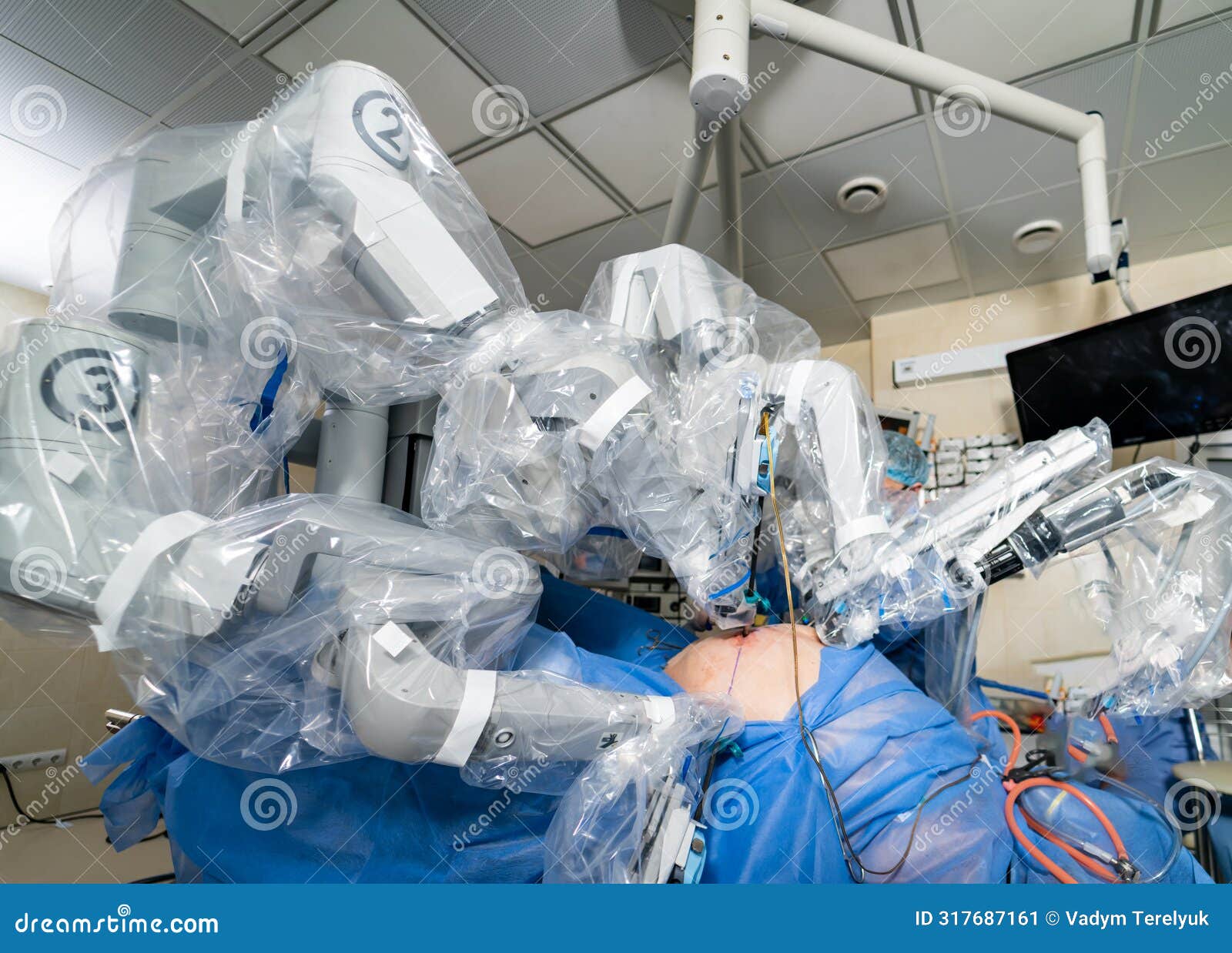 Medical Robotic Surgery Machine DaVinci. Manual Control By Minimally ...