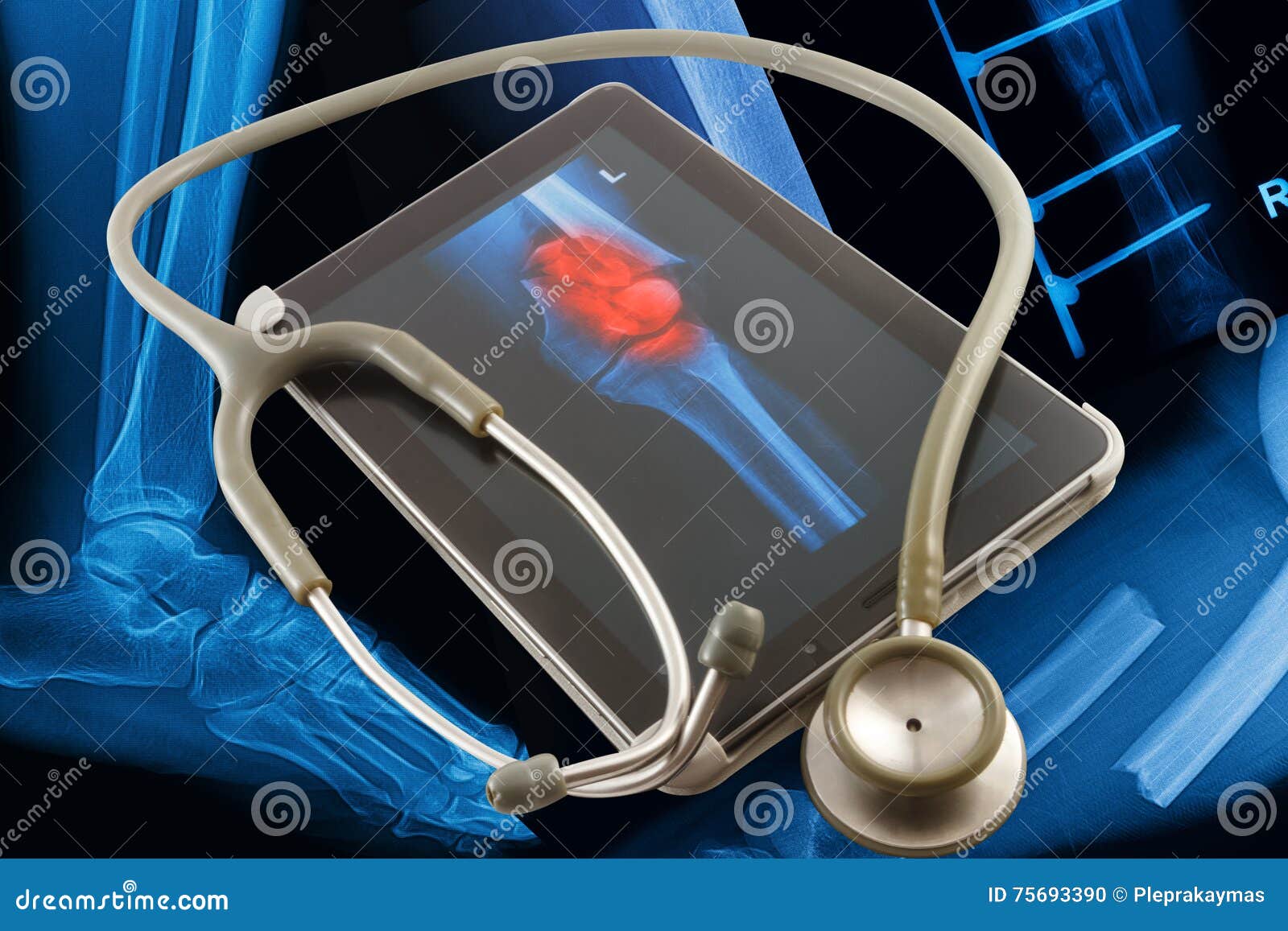 Modern Medical Tablet on X-rays Images Stock Photo - Image of diagnose ...