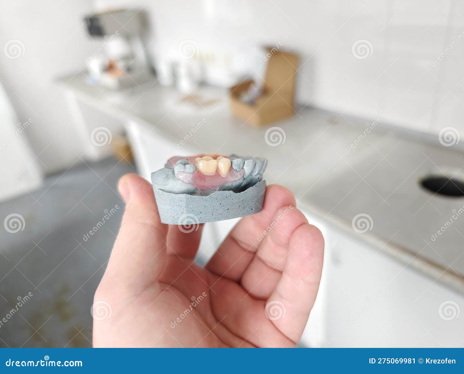 Modern Removable Nylon Prosthesis on a Plaster Model Stock Image ...