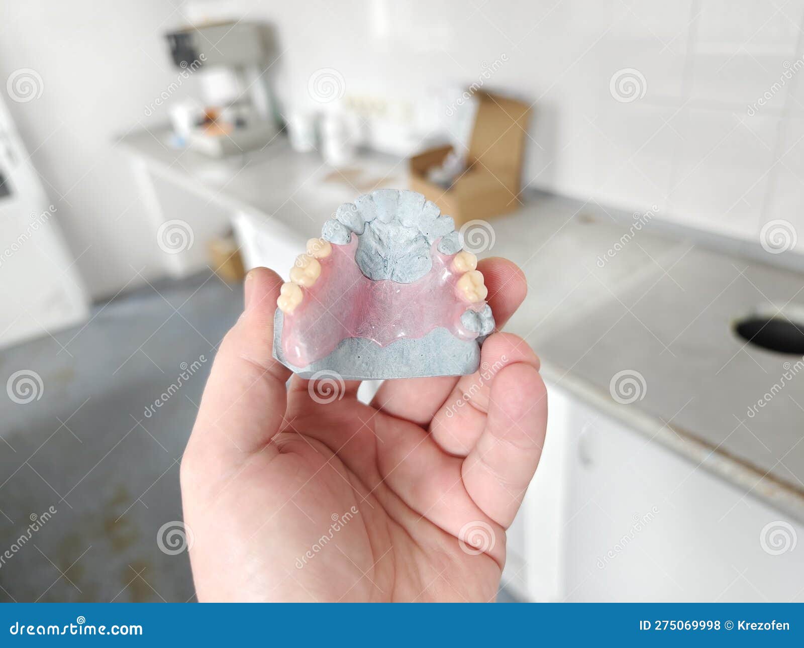 Modern Removable Nylon Prosthesis on a Plaster Model Stock Photo ...