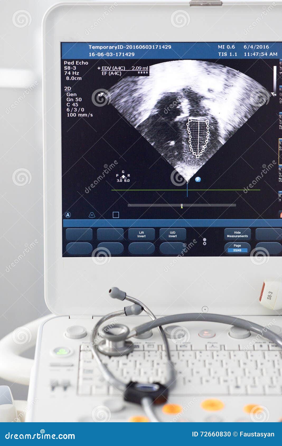 Modern ultrasound machine stock photo. Image of diagnostic - 72660830