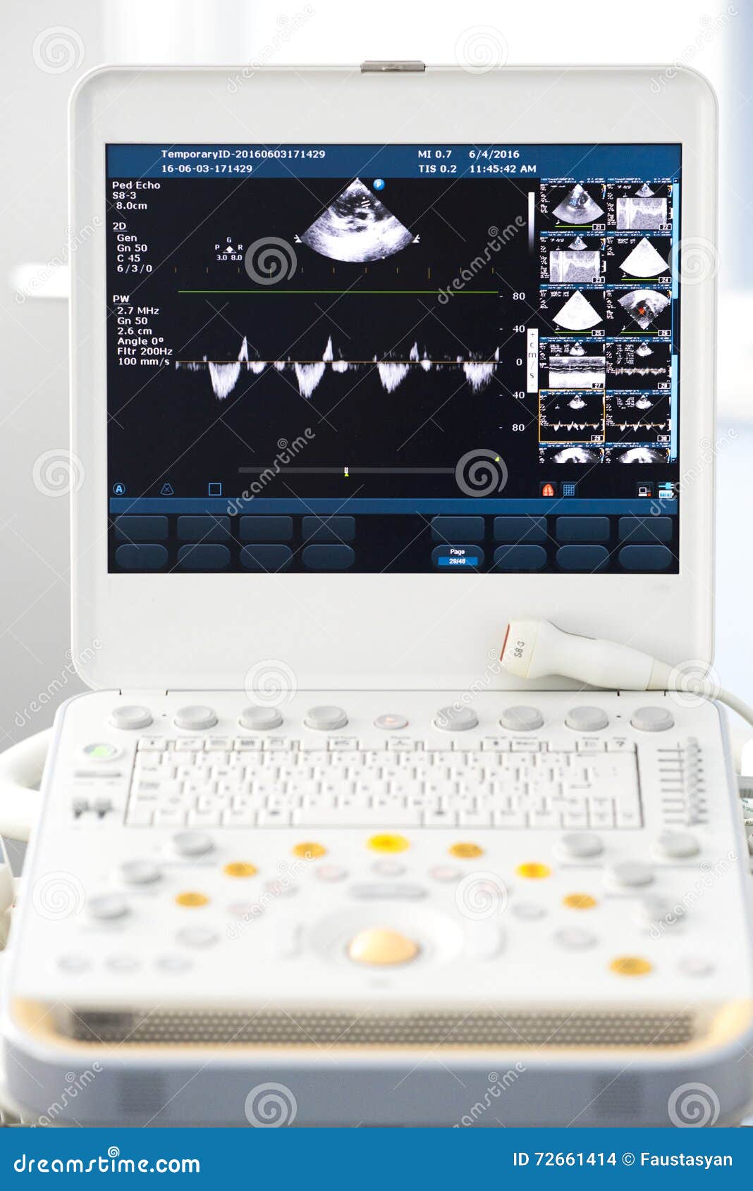 Modern ultrasound machine stock photo. Image of healthcare - 72661414