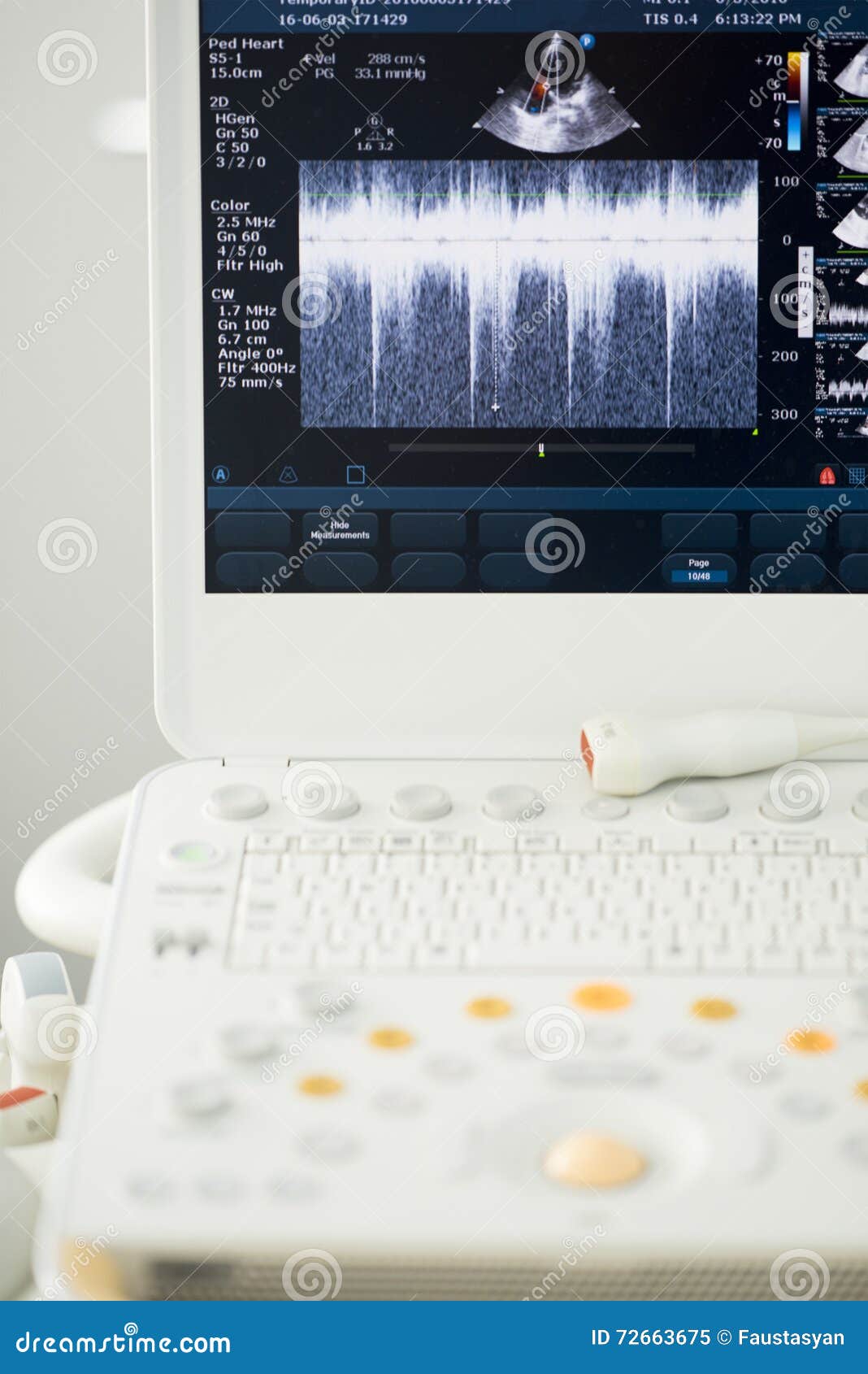 Modern ultrasound machine stock image. Image of doppler - 72663675