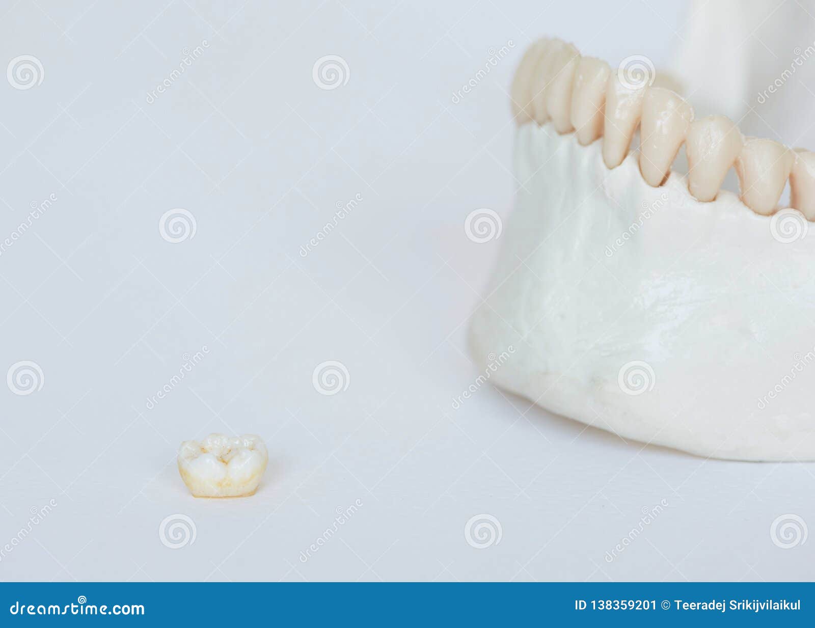 Molar Tooth and Jaw Bone Model on White Background Stock Image - Image ...
