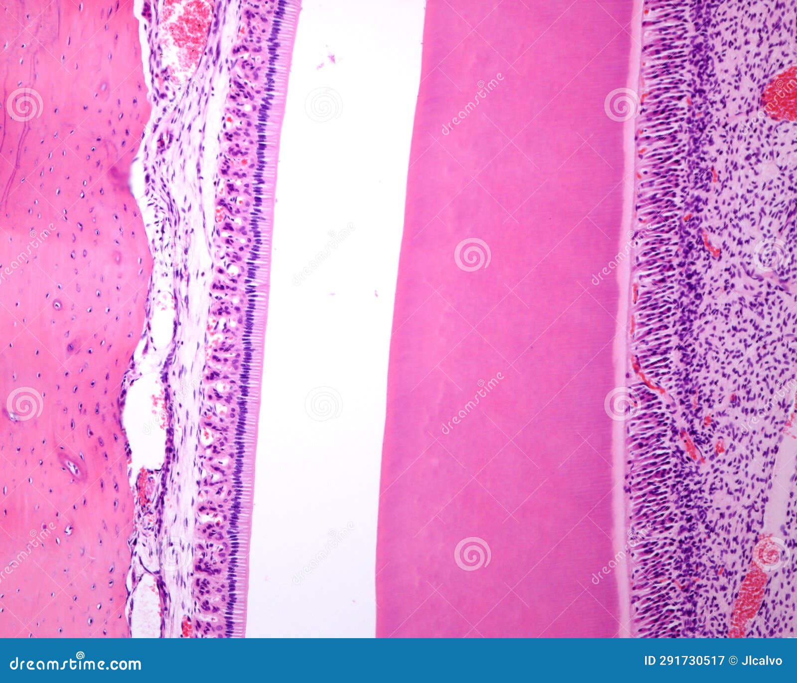 Molar tooth stock image. Image of dentin, pulp, predentin - 291730517