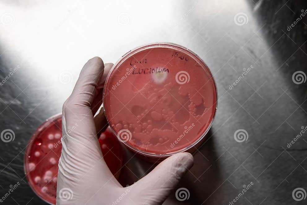 Mold and Bacteria on Red Agar. Agar Medium for Pathogens. Mold Spores ...