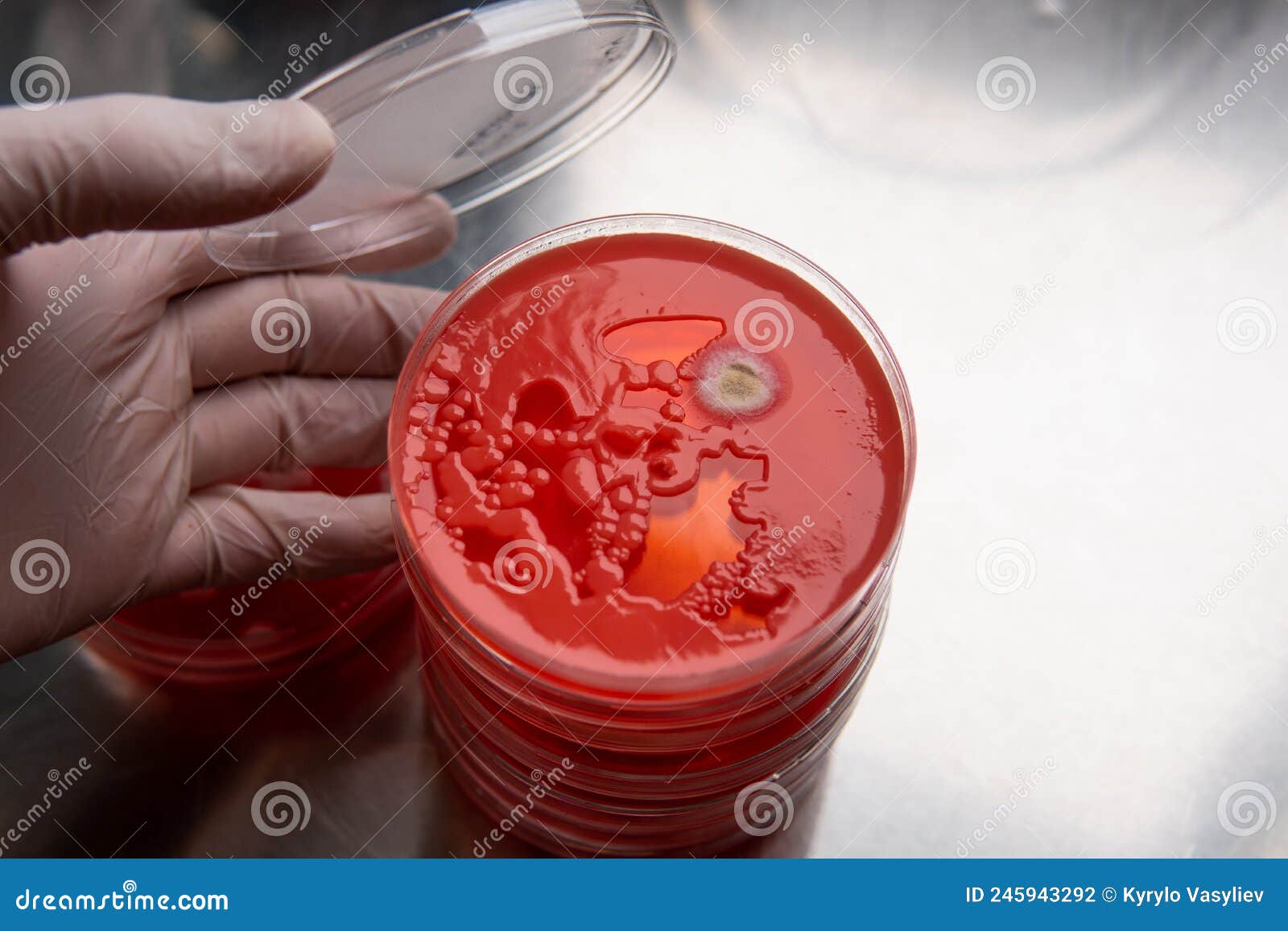 Mold and Bacteria on Red Agar. Agar Medium for Pathogens. Mold Spores ...