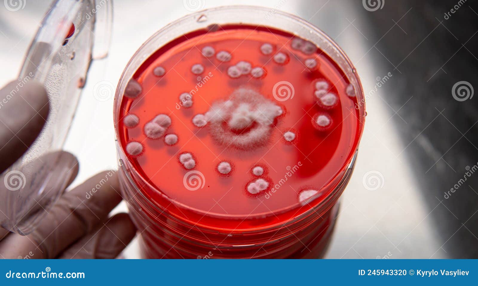 Mold and Bacteria on Red Agar. Agar Medium for Pathogens. Mold Spores ...
