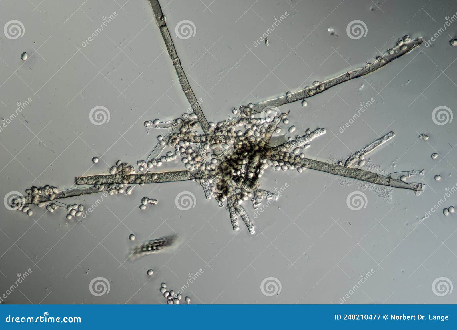 Mold filaments and spores stock image. Image of pollutants - 248210477
