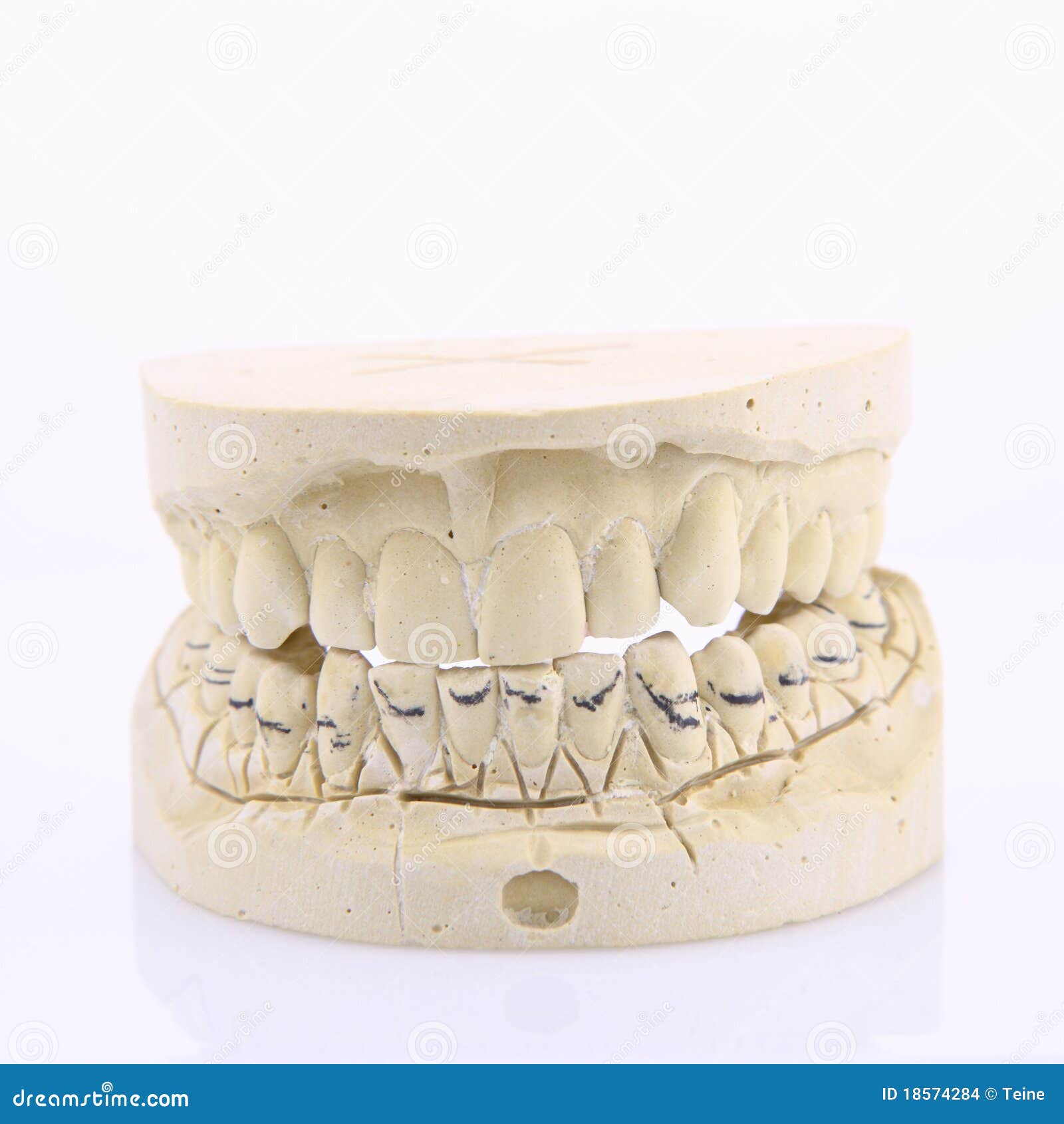 Mold of of human teeth stock photo. Image of mouth, fake - 18574284
