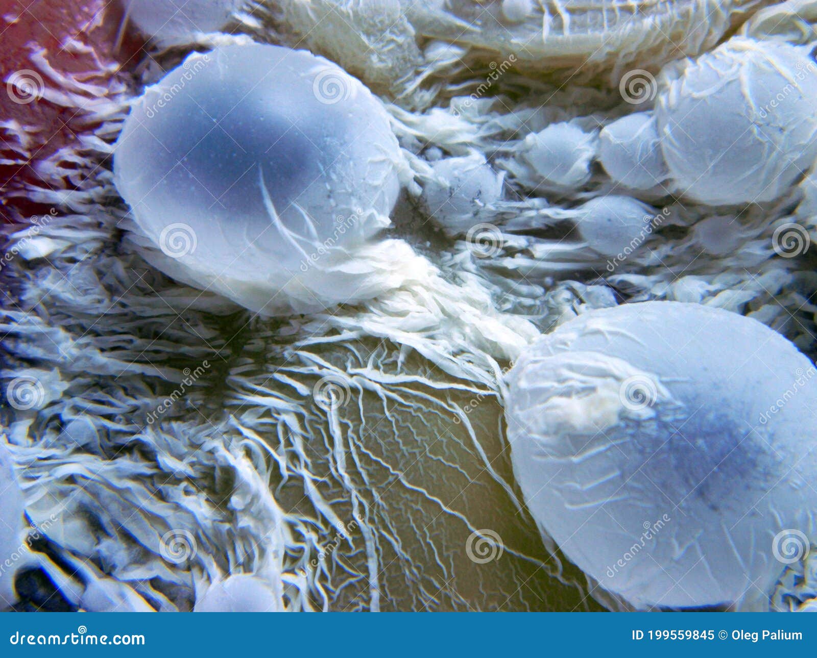 Mold Isolated on Black Background Stock Image - Image of delicious ...