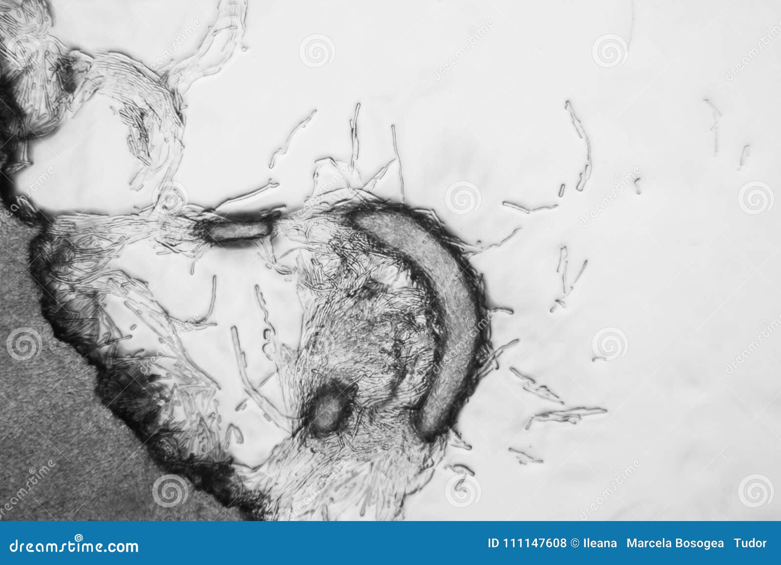 Mold at the microscope stock photo. Image of health - 111147608