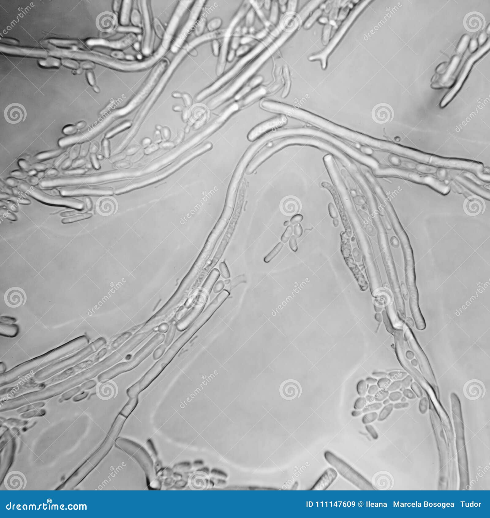 Mold at the microscope stock image. Image of mold, background - 111147609