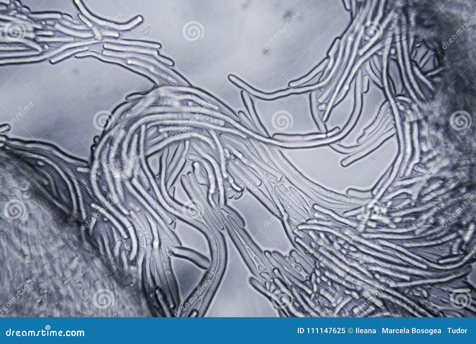 Mold at the microscope stock image. Image of microscope - 111147625