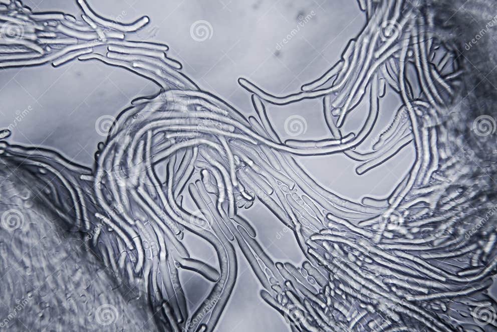 Mold at the microscope stock image. Image of microscope - 111147625