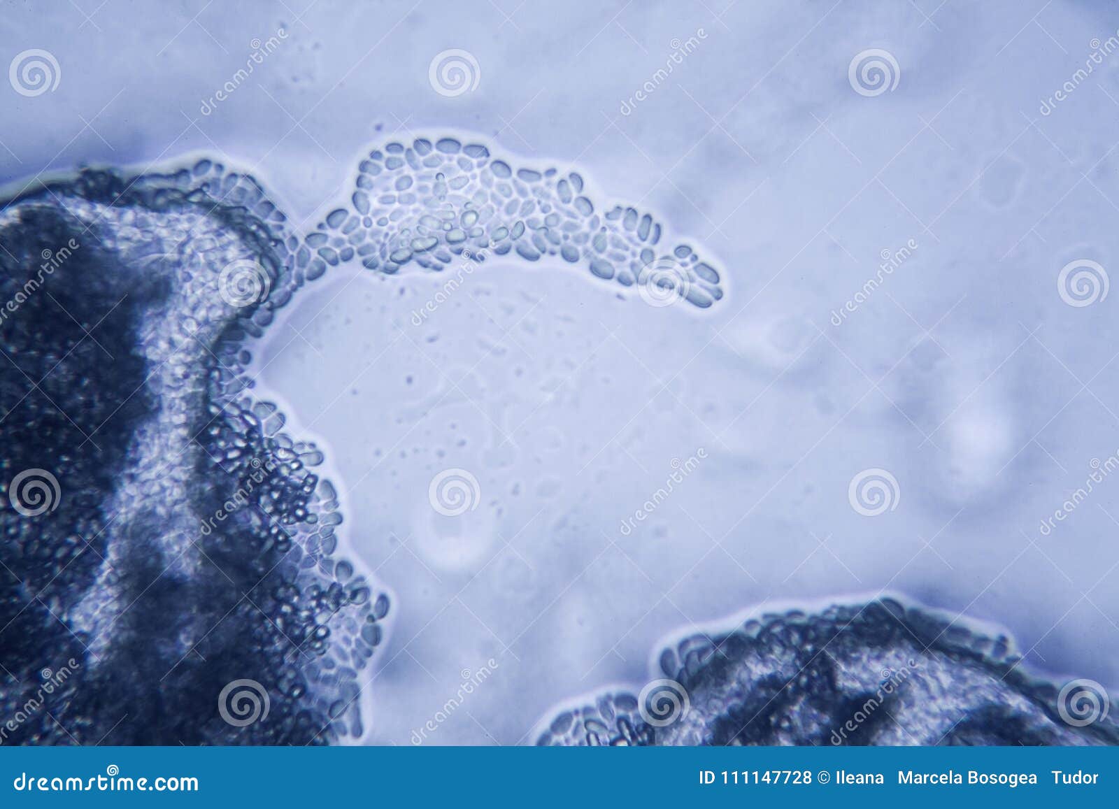 Mold at the microscope stock photo. Image of microscope - 111147728