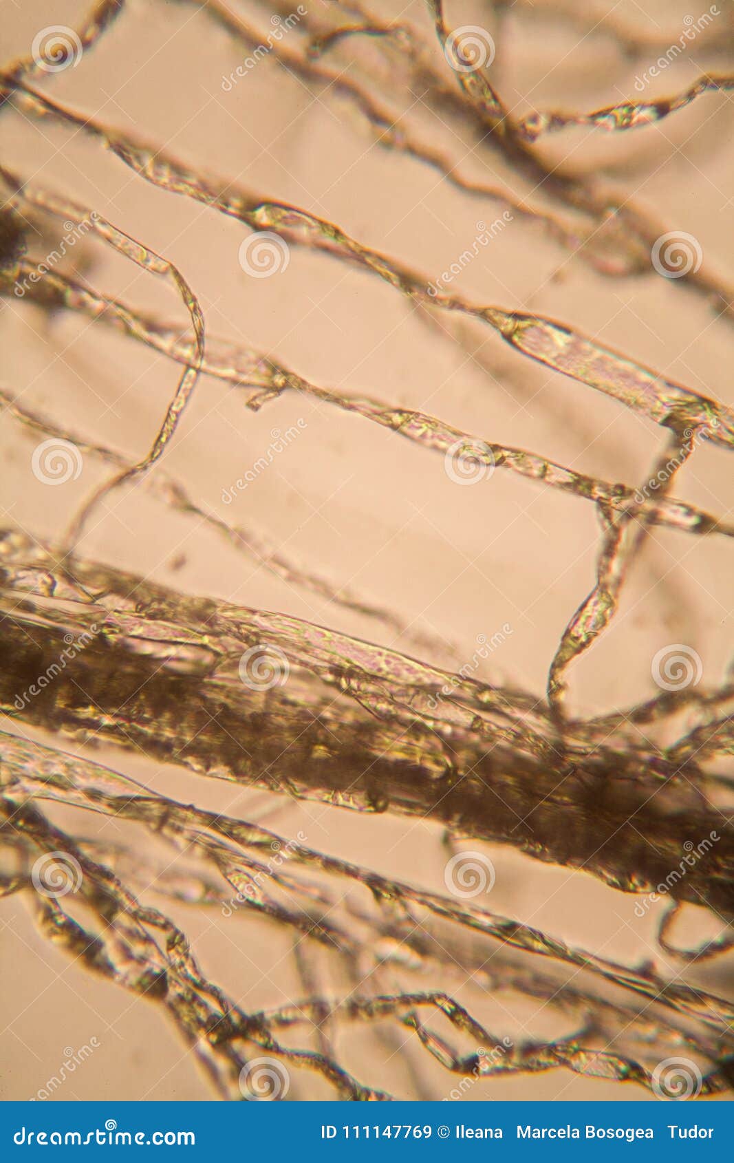 Mold at the microscope stock image. Image of microorganisms - 111147769