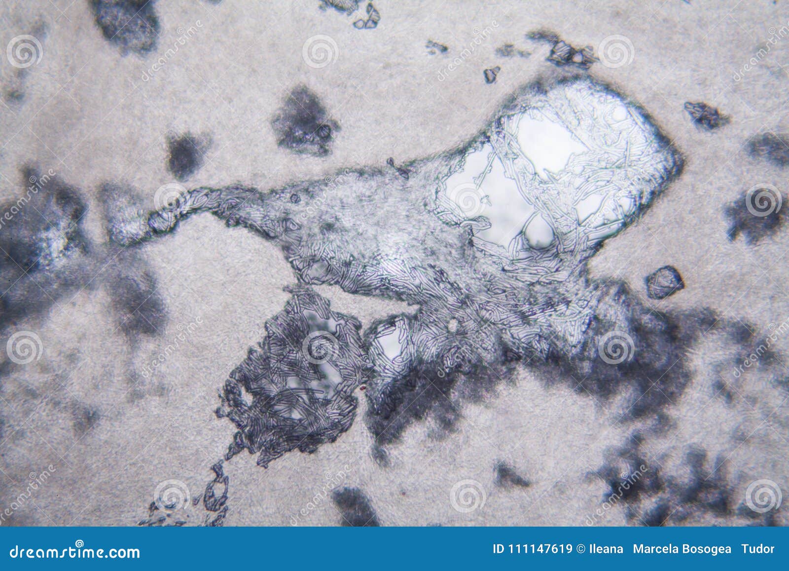 Mold at the microscope stock image. Image of microorganisms - 111147619