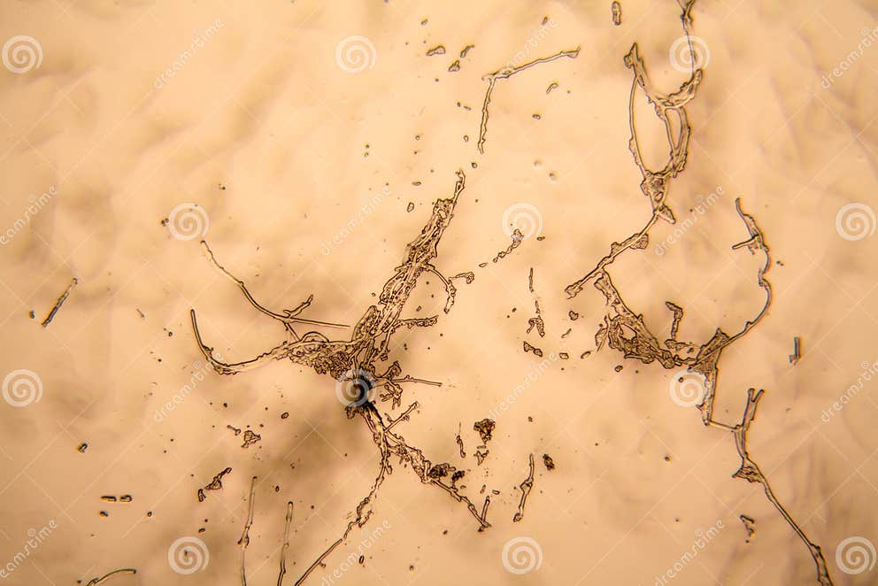 Mold at the microscope stock photo. Image of closeup - 111147620